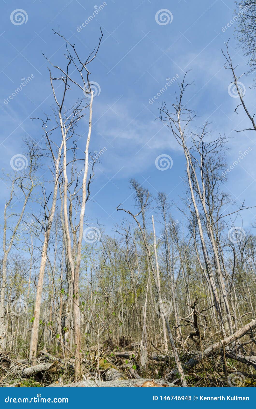 Elm Trees Damaged by the Dutch Elm Disease in a Bright Swedish Forest ...