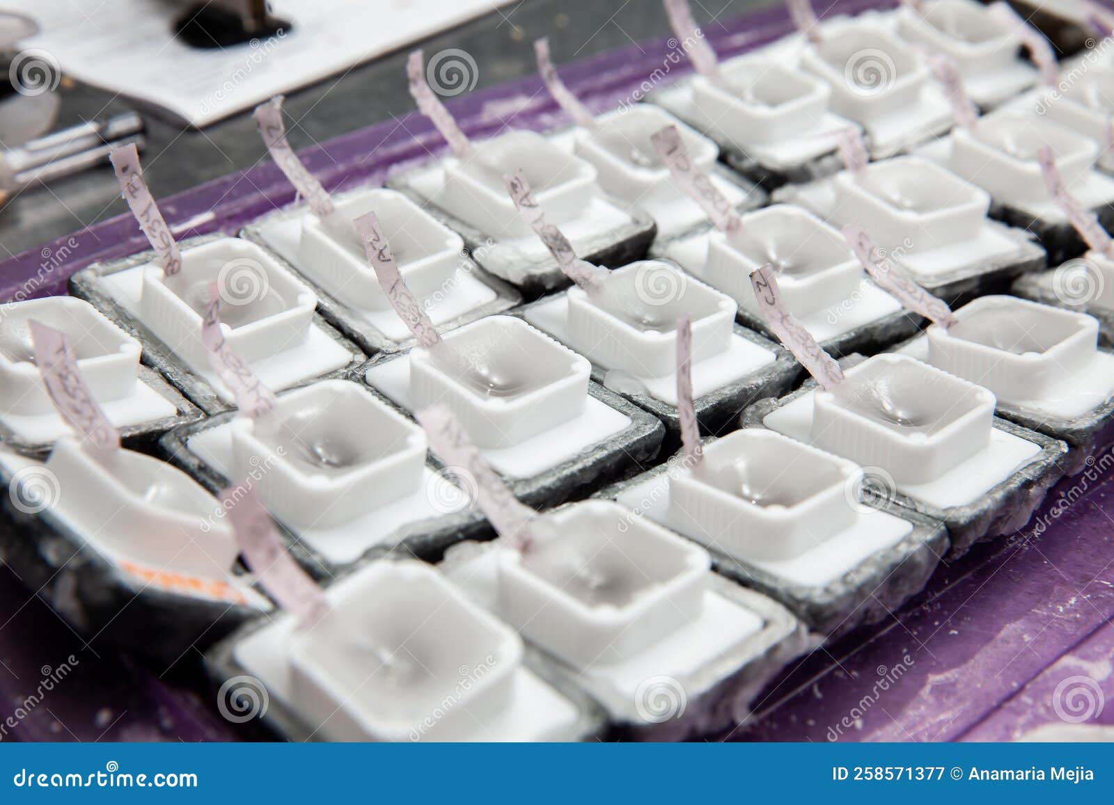Embedded Tissues in Paraffin Blocks for Sectioning. Pathology ...