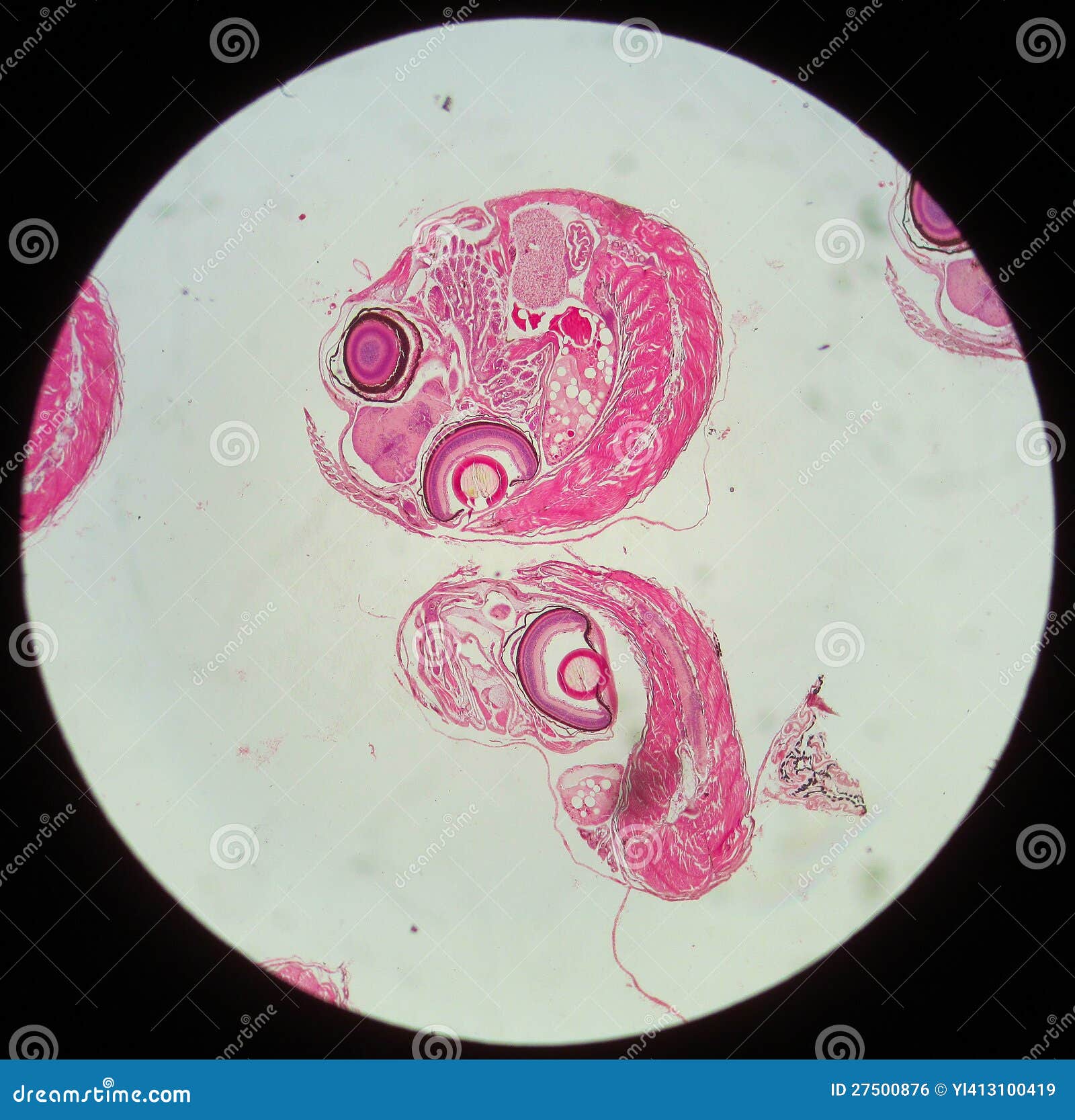 The embryo stock photo. Image of technique, organism - 27500876