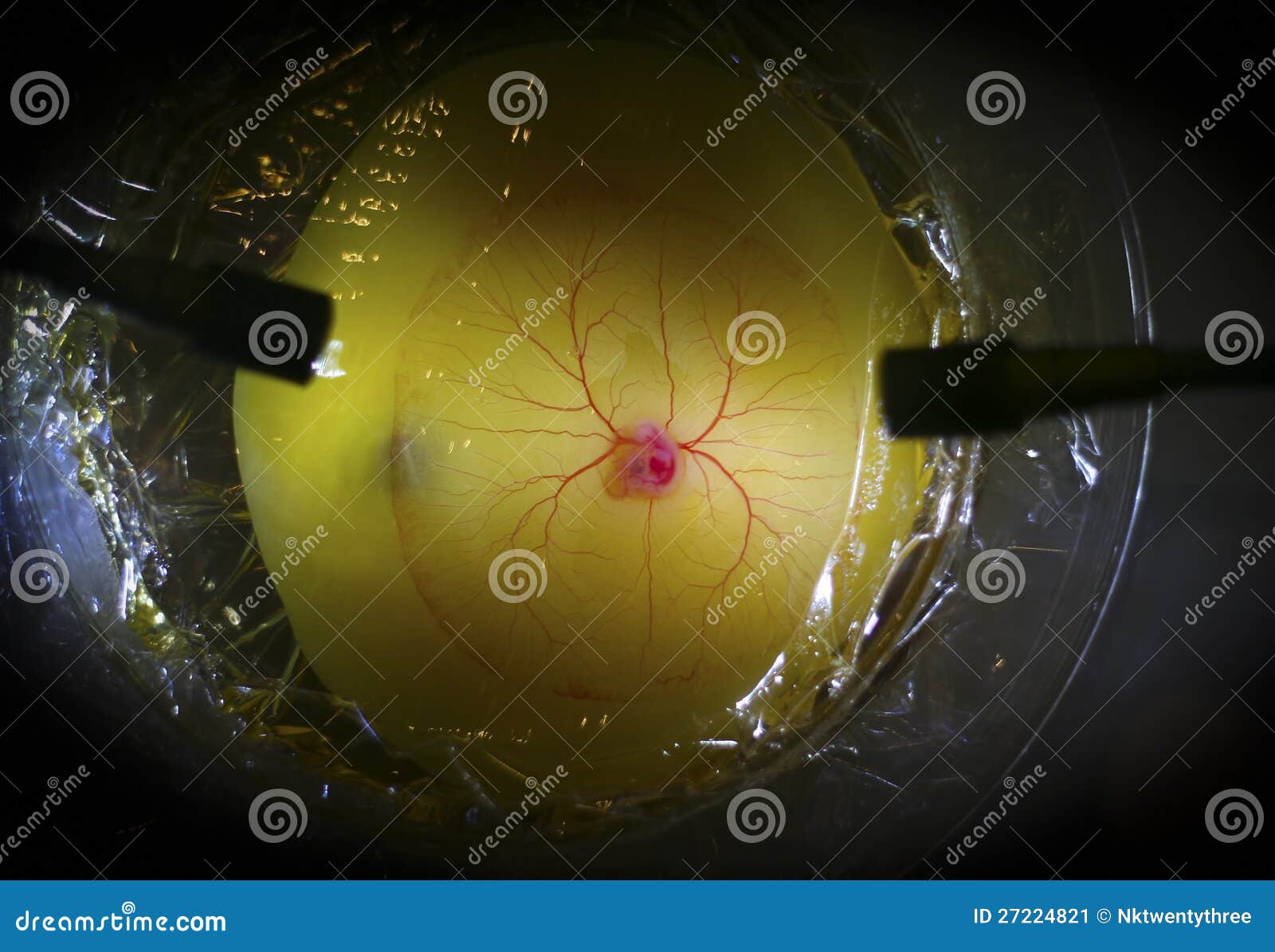 Embryo in a petri dish stock image. Image of growth, laboratories ...
