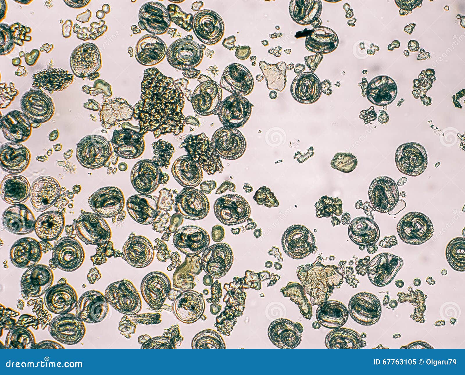 Embryonated Ei Toxocara Canis Mit Larve Stockbild - Bild von menschlich ...