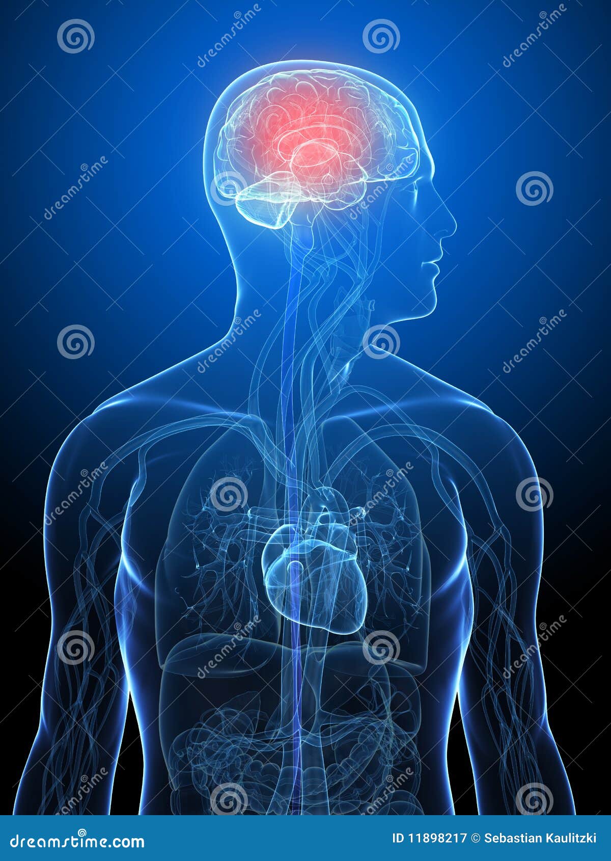 Emicrania/emicrania illustrazione di stock. Illustrazione di neurologia ...