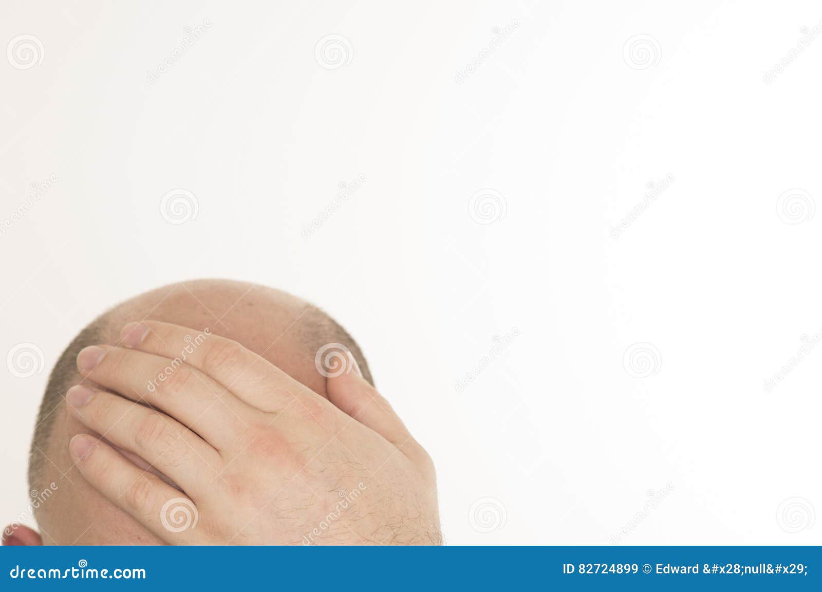 Hand on Mans Head Indicating Emotion, Worry Stock Image - Image of ...
