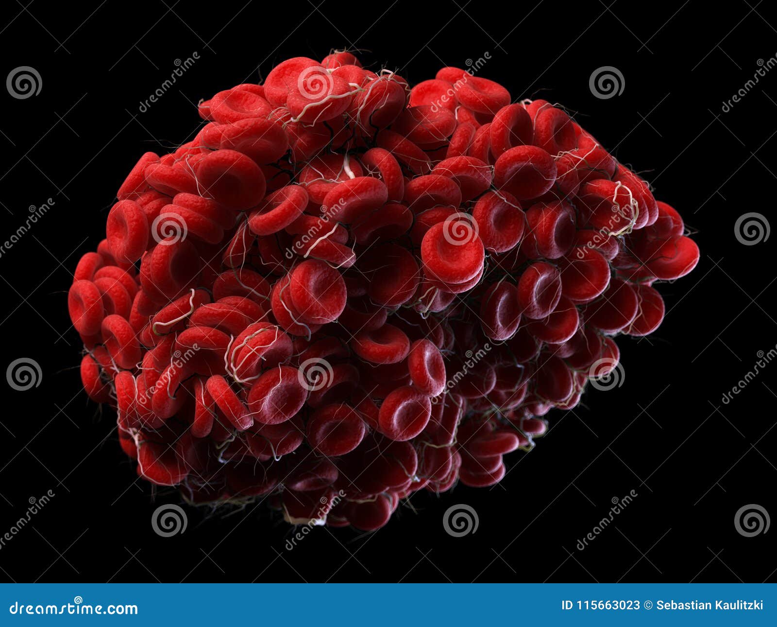 En blodpropp stock illustrationer. Illustration av diagram - 115663023