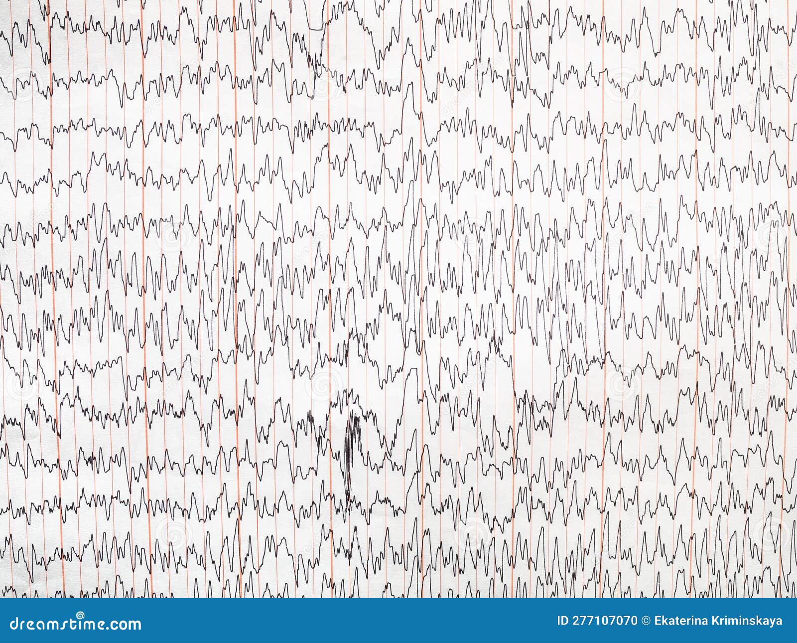 Encephalogram, Graph of Activity of Brain Stock Illustration ...