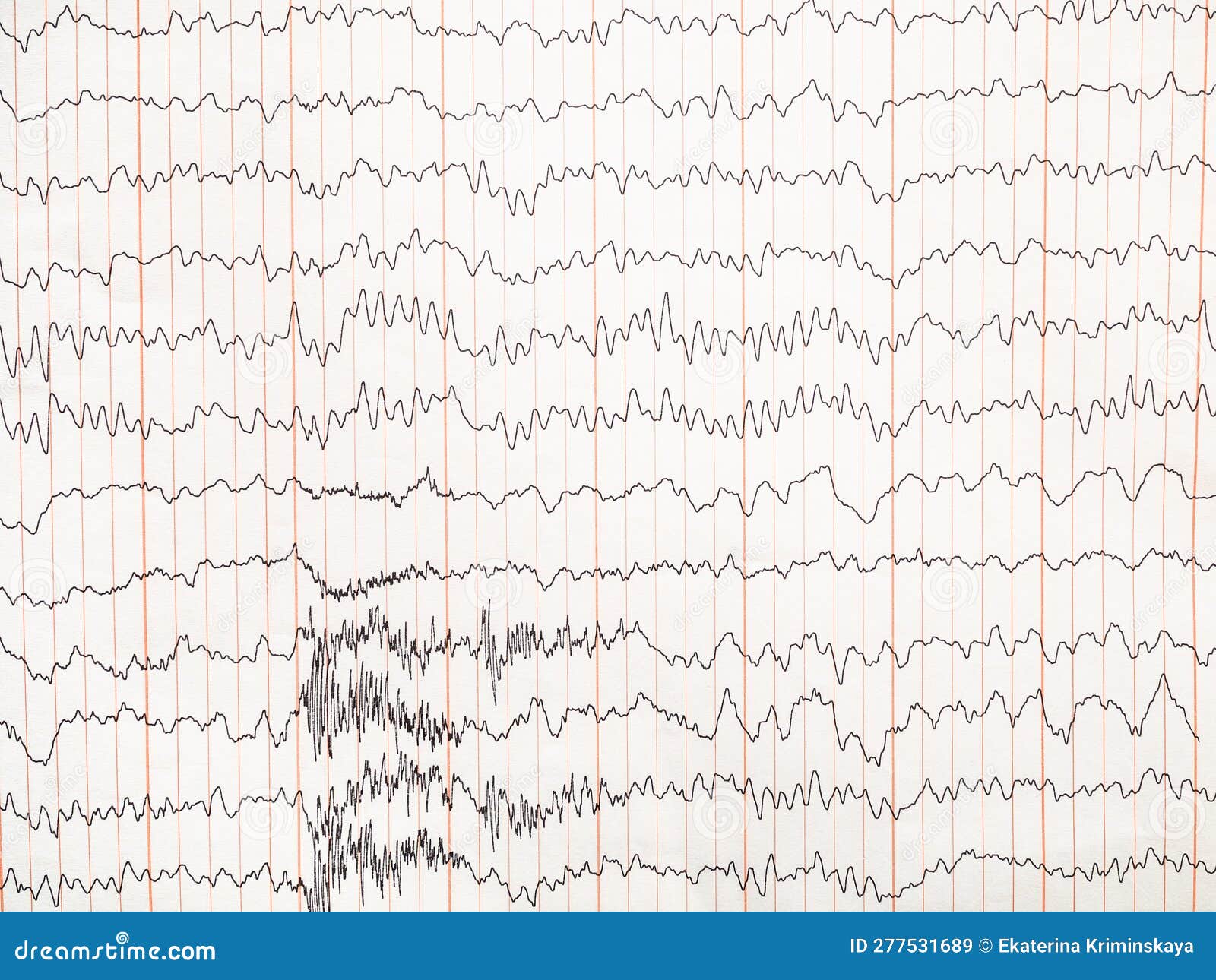 Encephalogram on Paper, Record of Brain Activity Stock Illustration ...