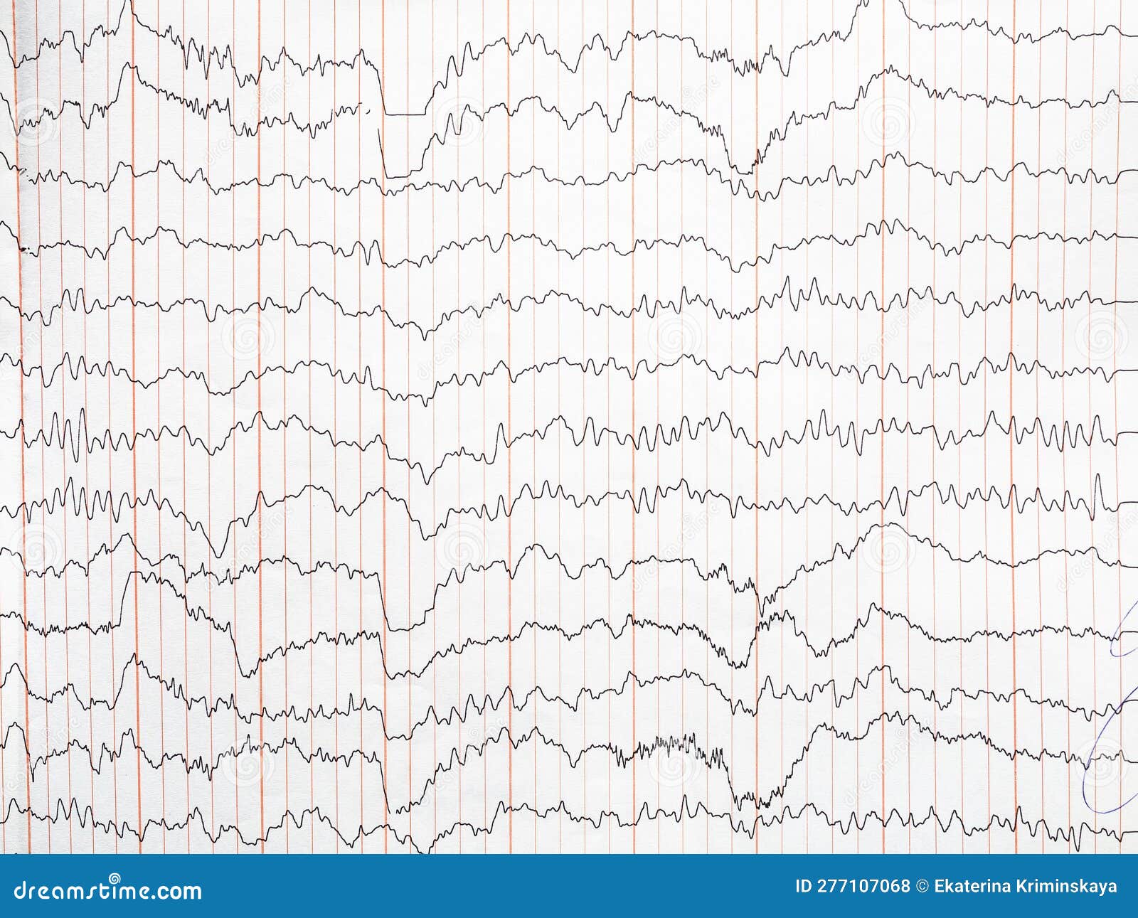 Encephalogram On Paper, Trace Of Activity Of Brain Stock Photography ...