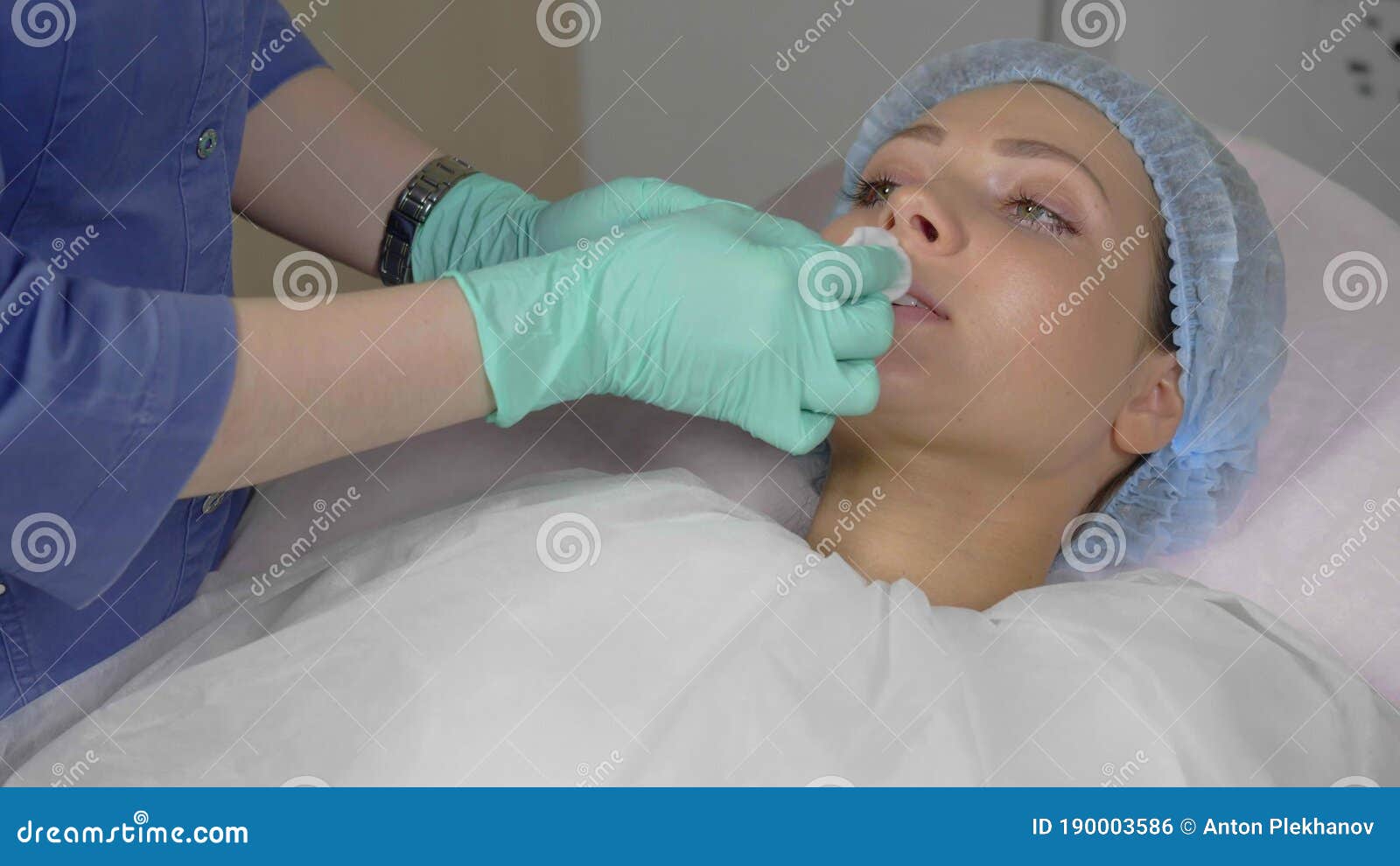 Rubbing the Lips with a Cotton Disc after the Lip Augmentation ...