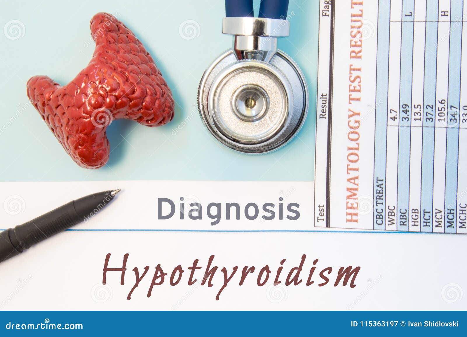 Endocrinology Diagnosis Hypothyroidism Figure Of Thyroid Gland Result