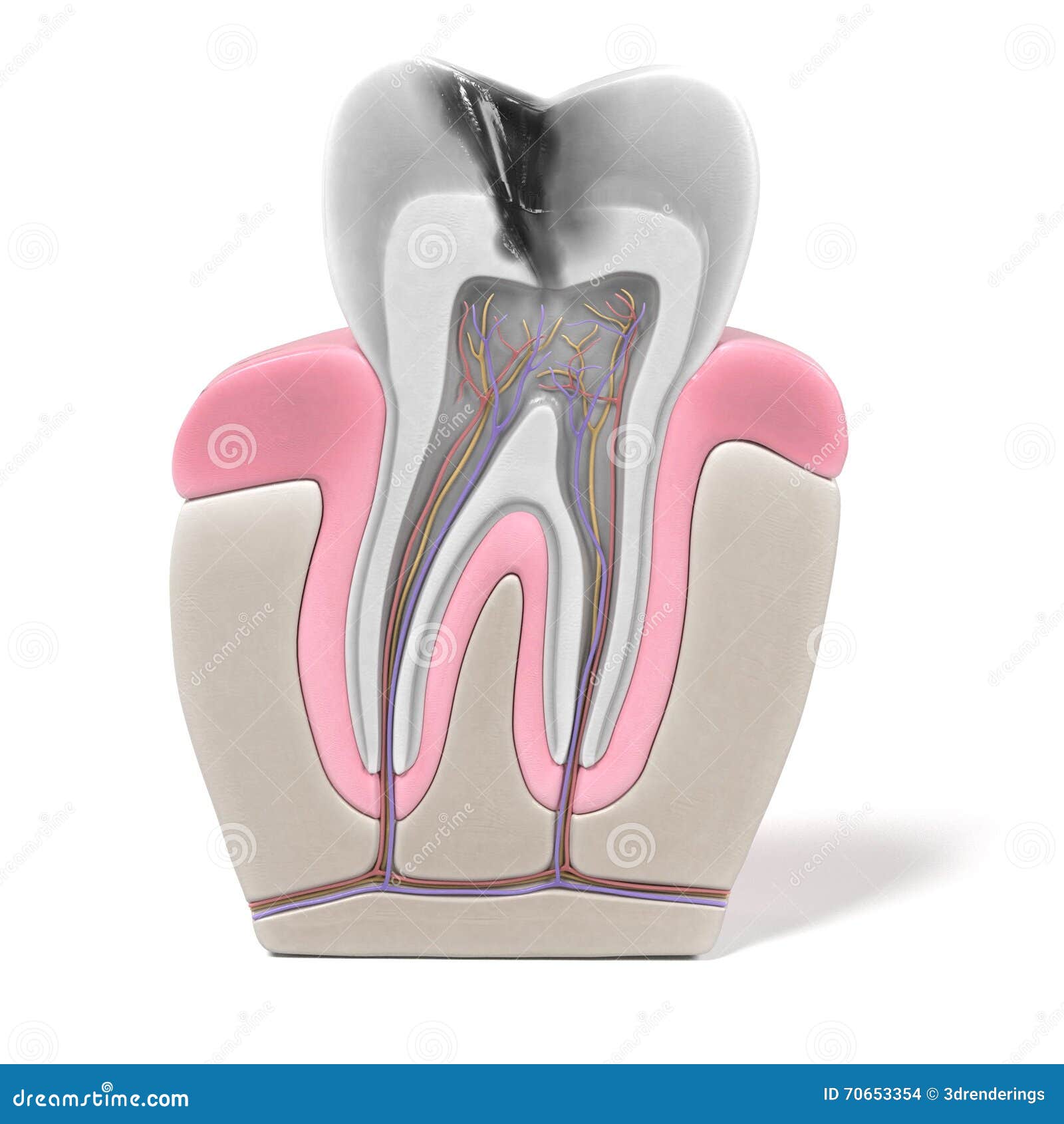 Endodontics - Procedimiento De La Endodoncia Stock de ilustración ...