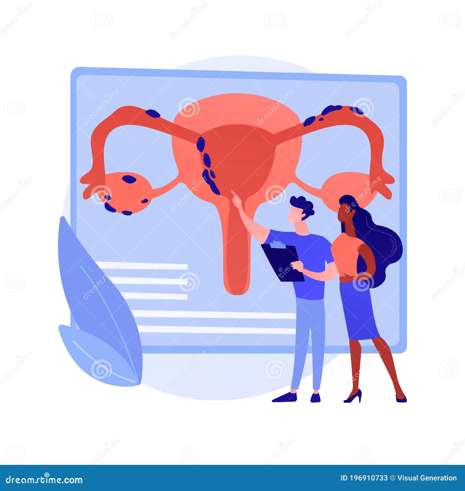 Endometriosis Abstract Concept Vector Illustration. Stock Vector ...