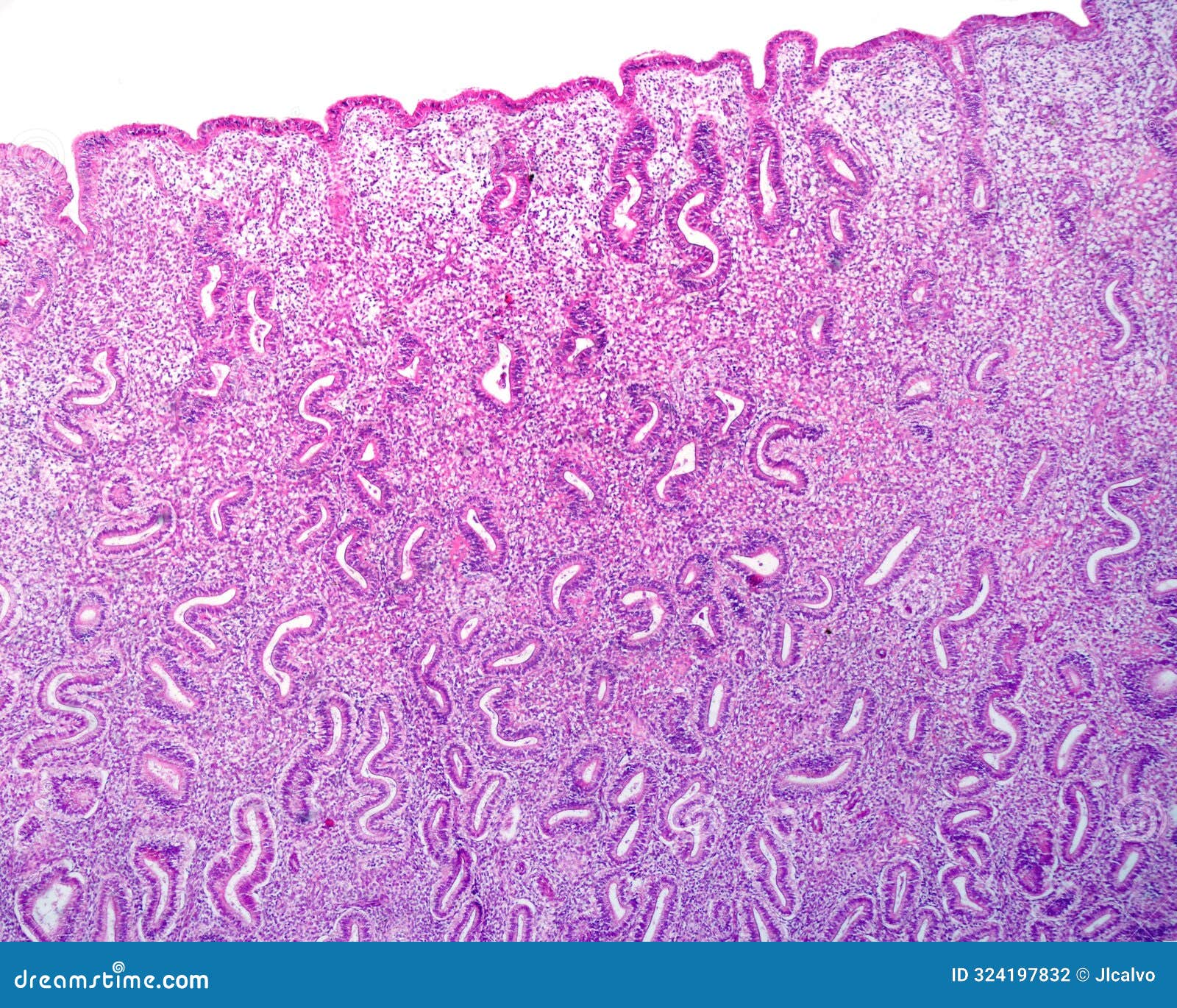 Endometrium. Basal Layer. Late Proliferative Phase Stock Photo - Image ...