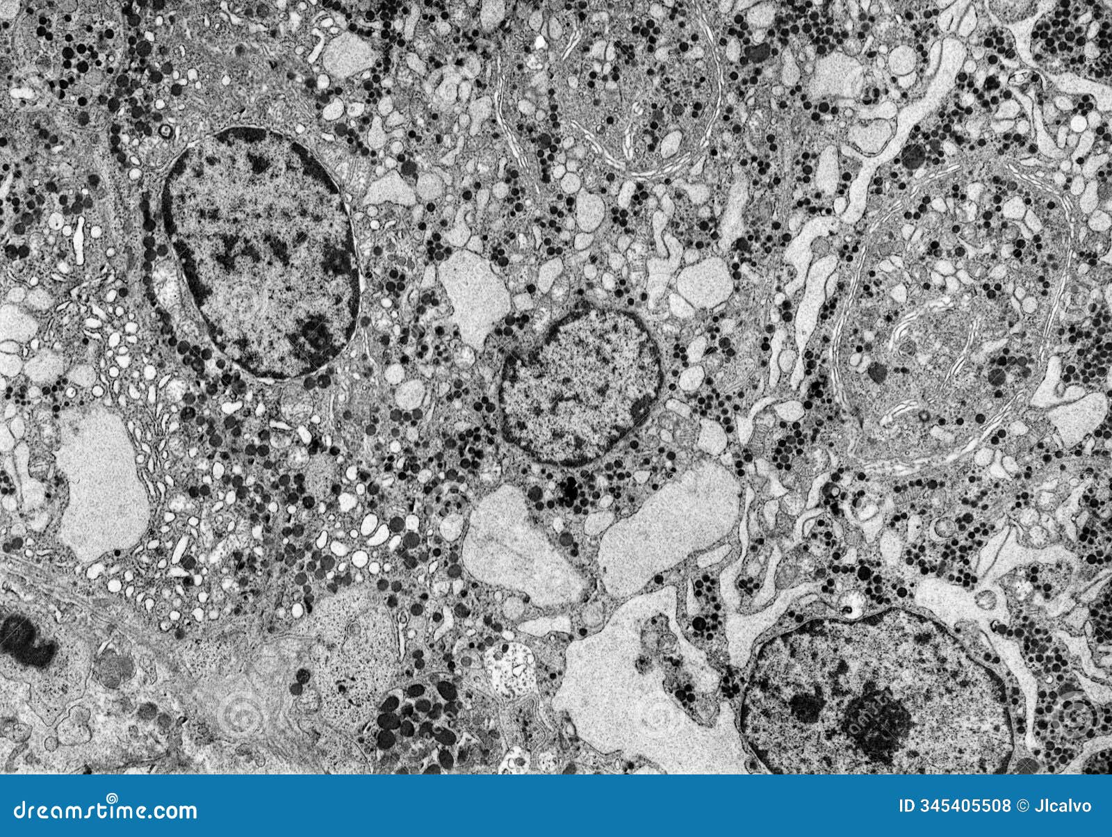 Endoplasmic reticulum stock photo. Image of reticular - 345405508