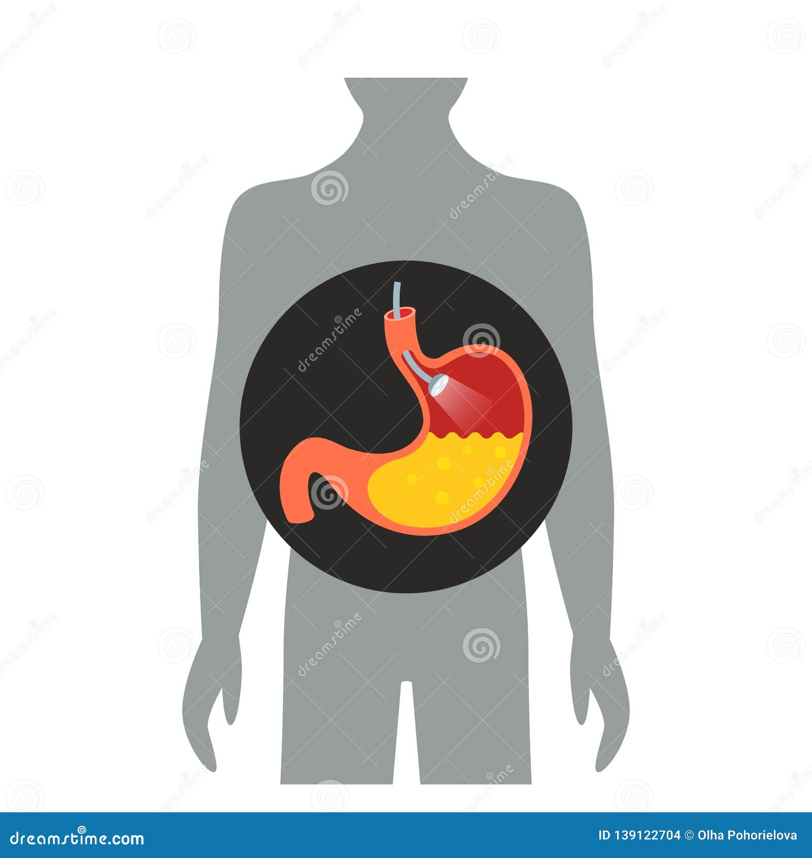 Endoscope Light on Examination in the Stomach Stock Illustration ...
