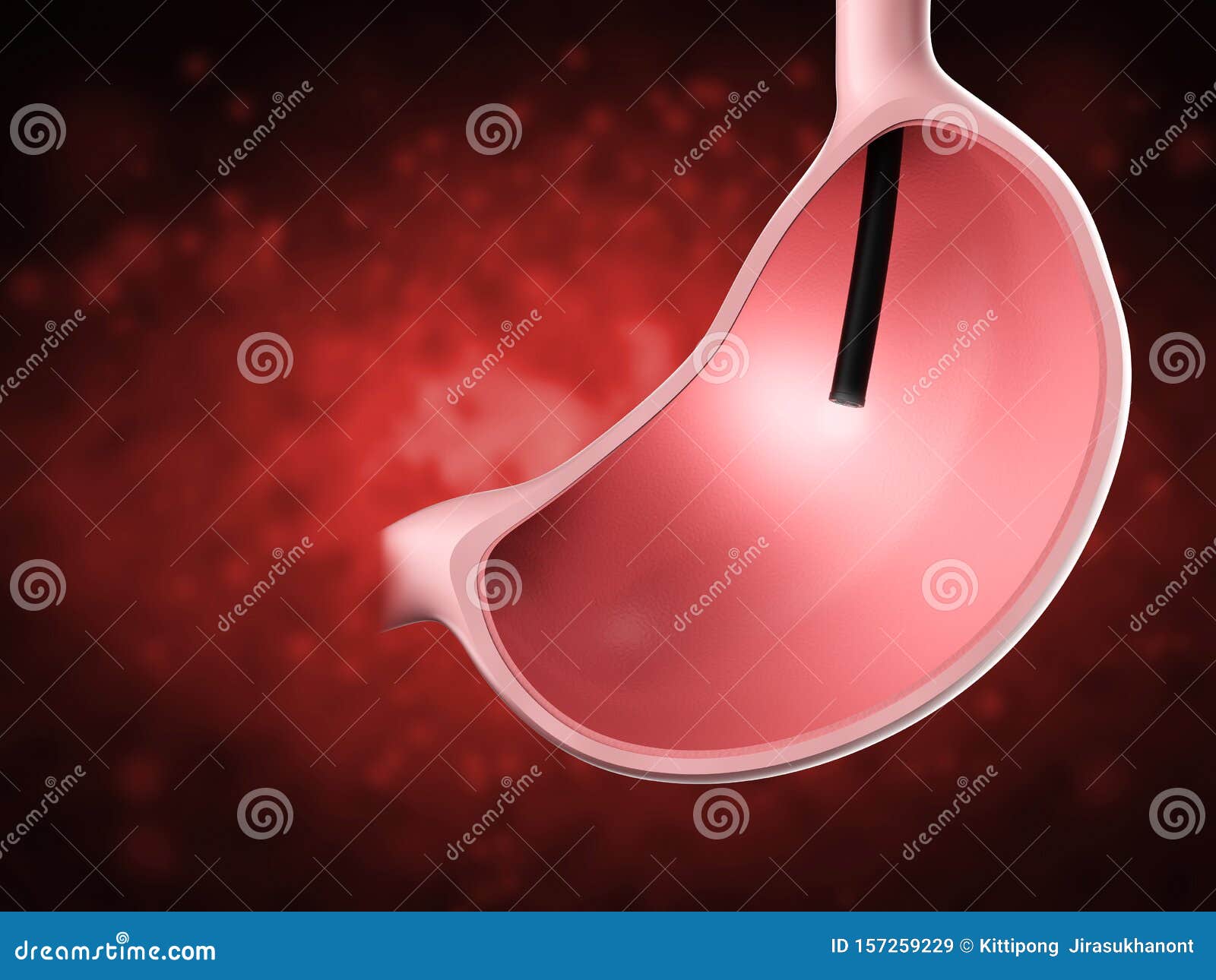 Endoscope in stomach stock illustration. Illustration of intestine ...