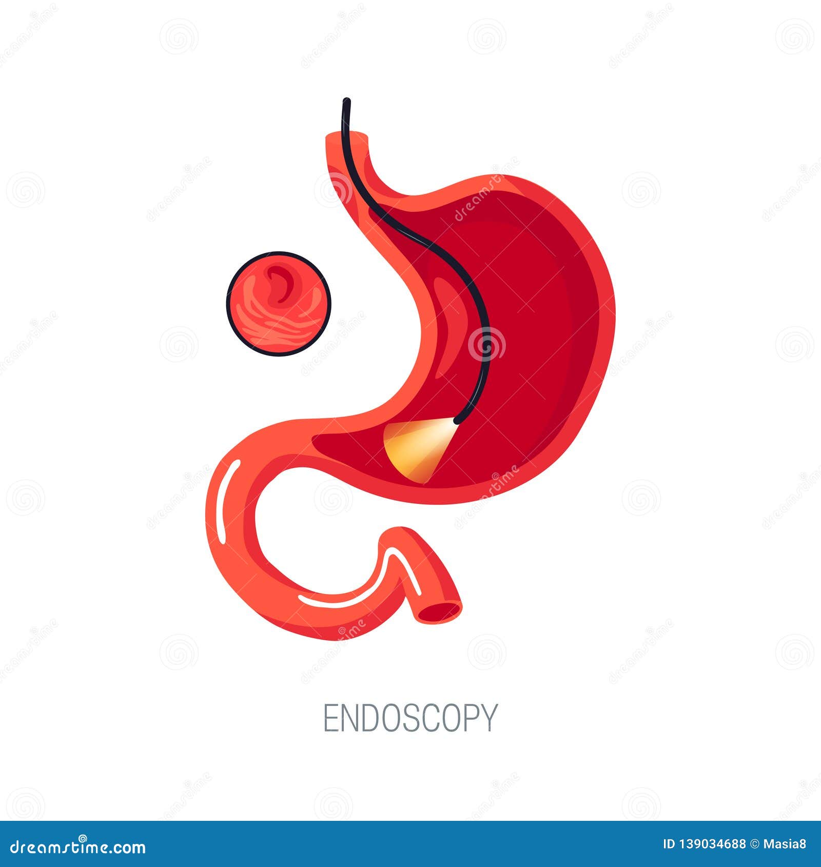 Endoscopy Diagnostic, Concept In Flat Style Royalty-Free Illustration ...