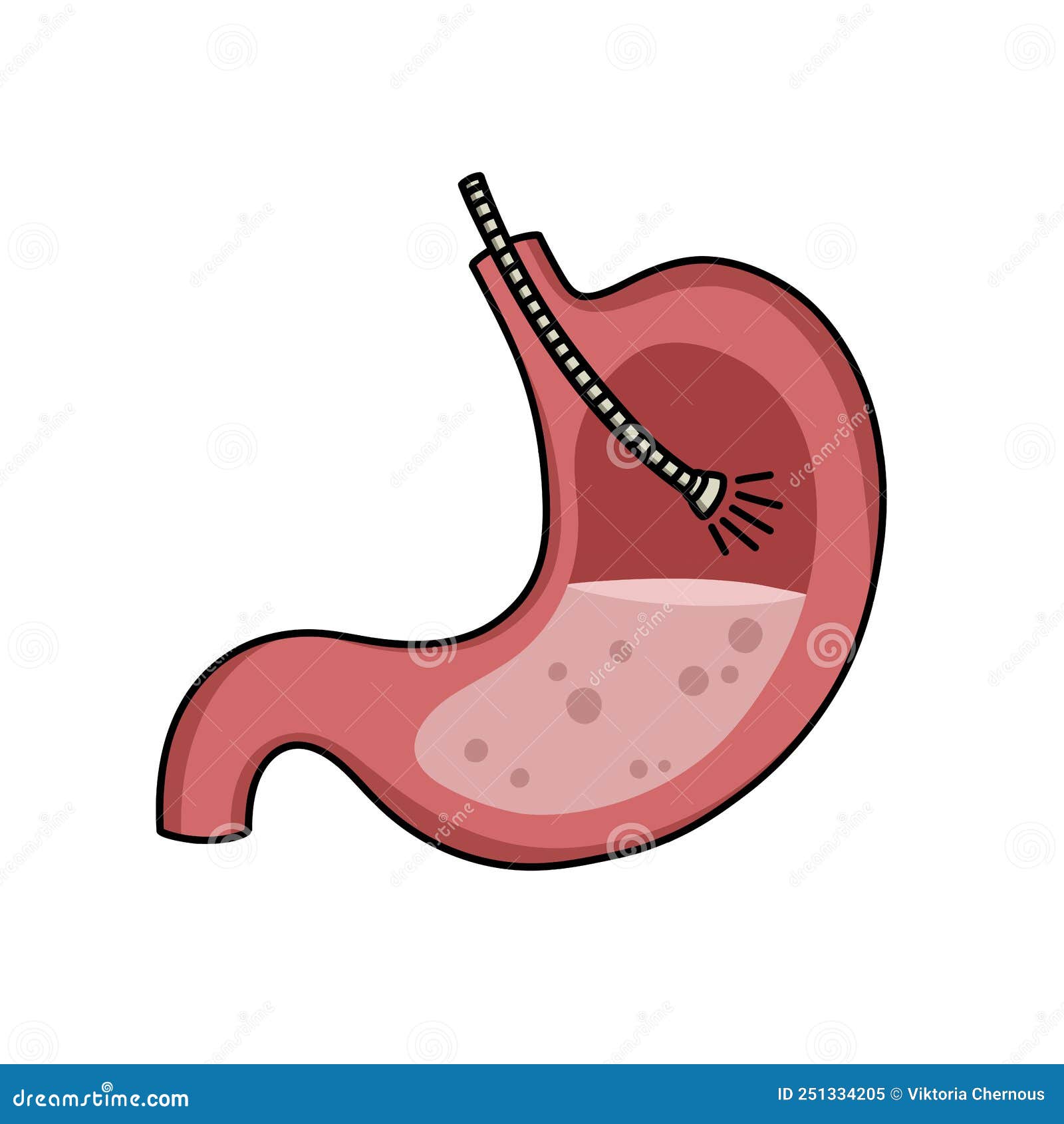 Endoscopy Doodle Icon, Vector Color Line Illustration Stock Vector ...
