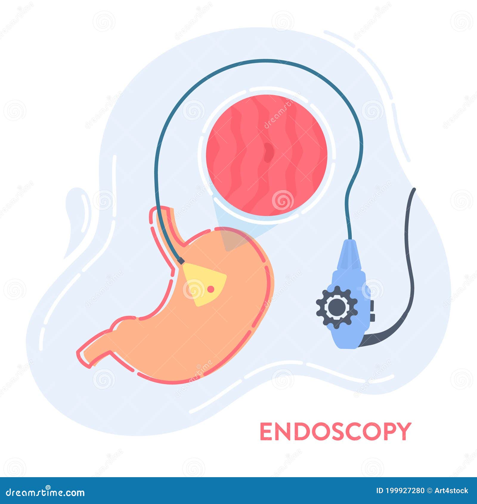 Gastroscopy Procedure Of Stomach Examination With Endoscope Stock