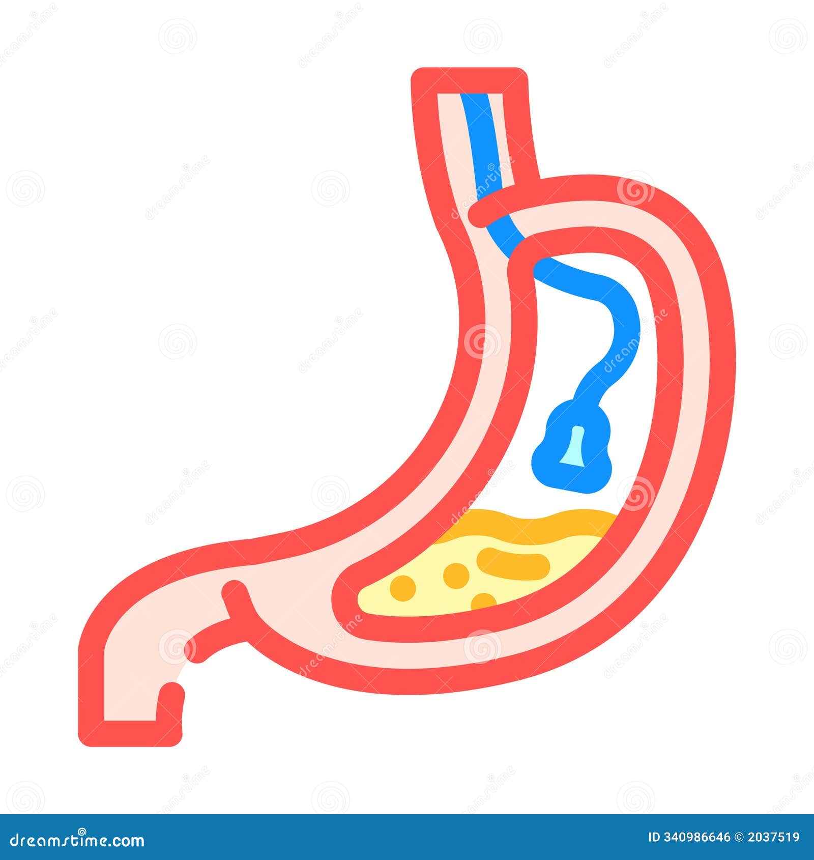 Endoscopy Surgery Color Icon Vector Illustration Stock Illustration ...