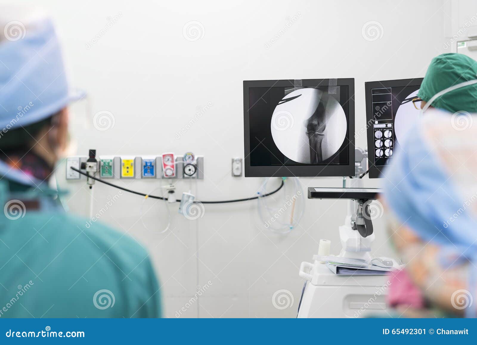 Endovascular intervention stock image. Image of bioengineering - 65492301