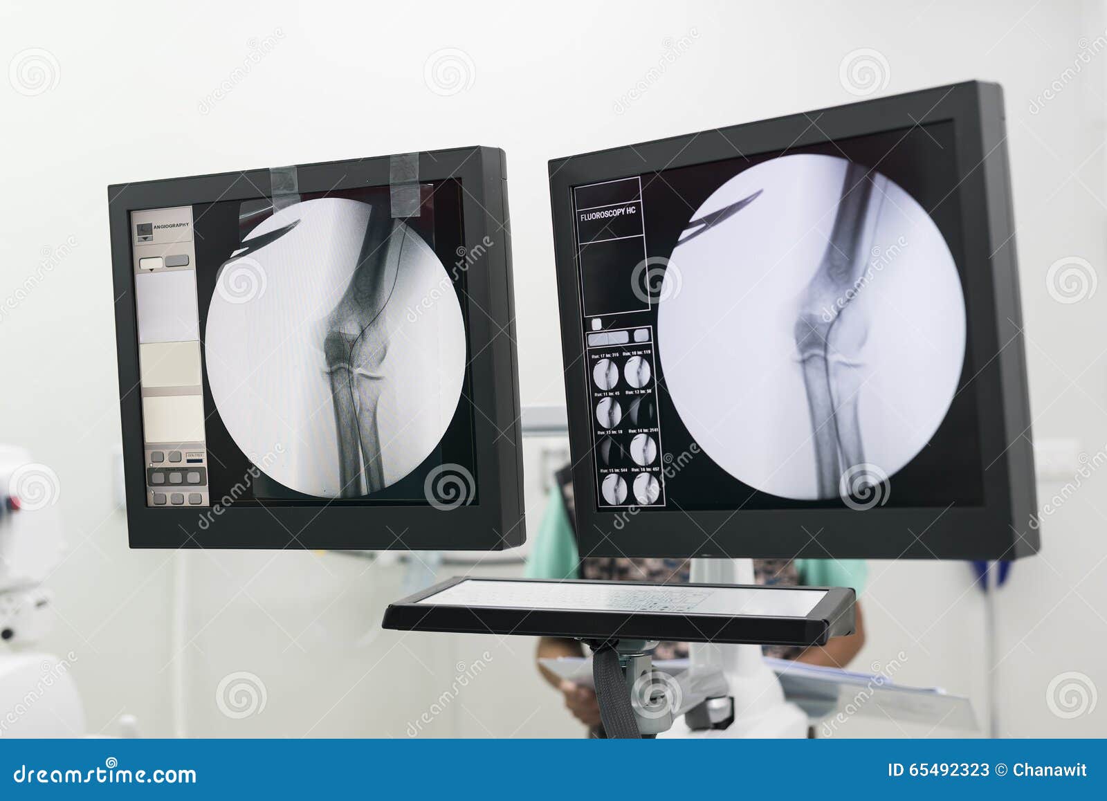Endovascular intervention stock image. Image of professional - 65492323