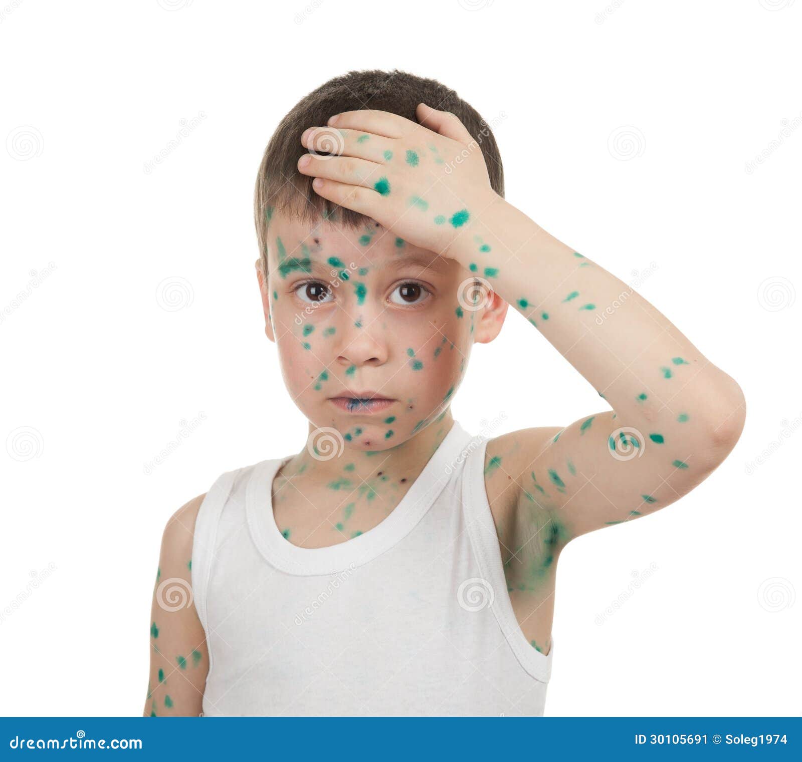 Enfant malade. varicelle image stock. Image du caucasien - 30105691