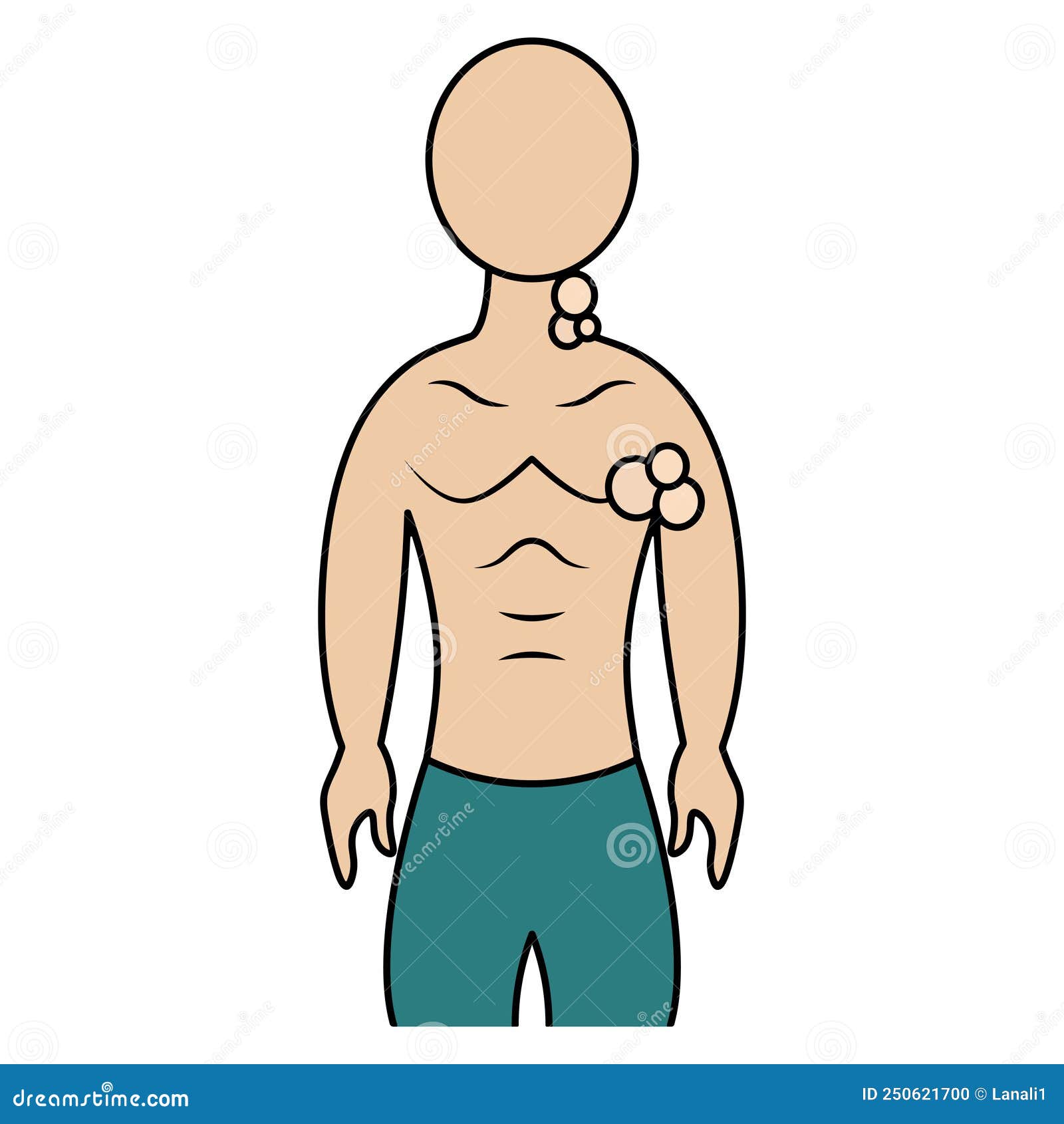 Enlarged Lymph Nodes Color Vector Illustration Stock Vector