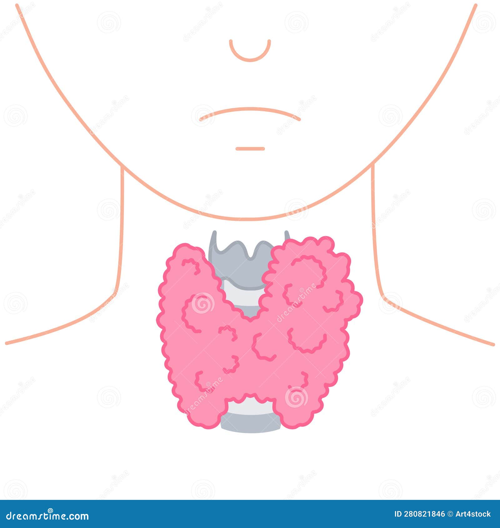 Enlarged Thyroid Gland on Neck Silhouette Diagram Stock Vector ...
