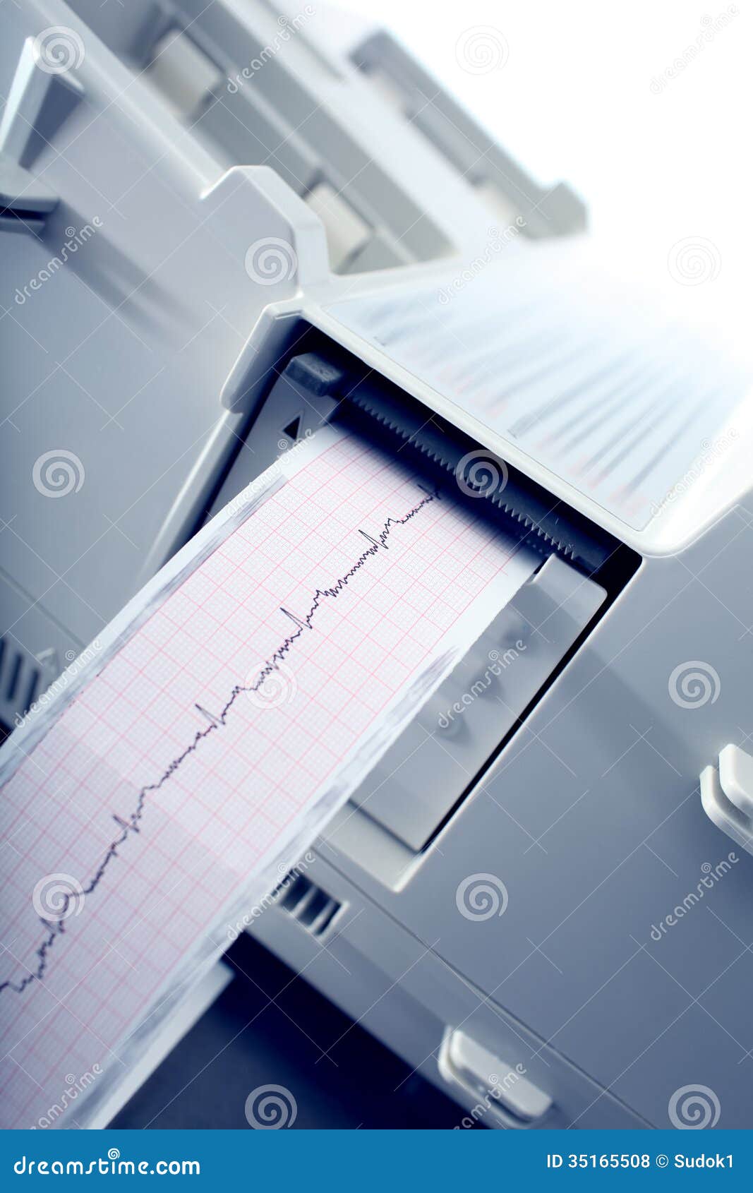 Enregistrement De Cardiogramme. Photo stock - Image du battement ...