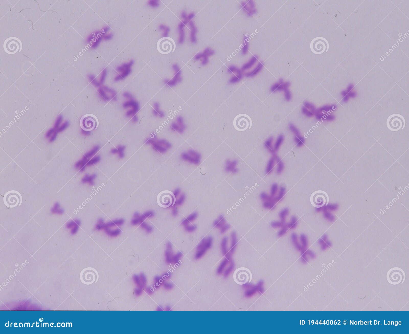 Ensemble De Chromosome Humain Photo stock - Image du positionnement ...