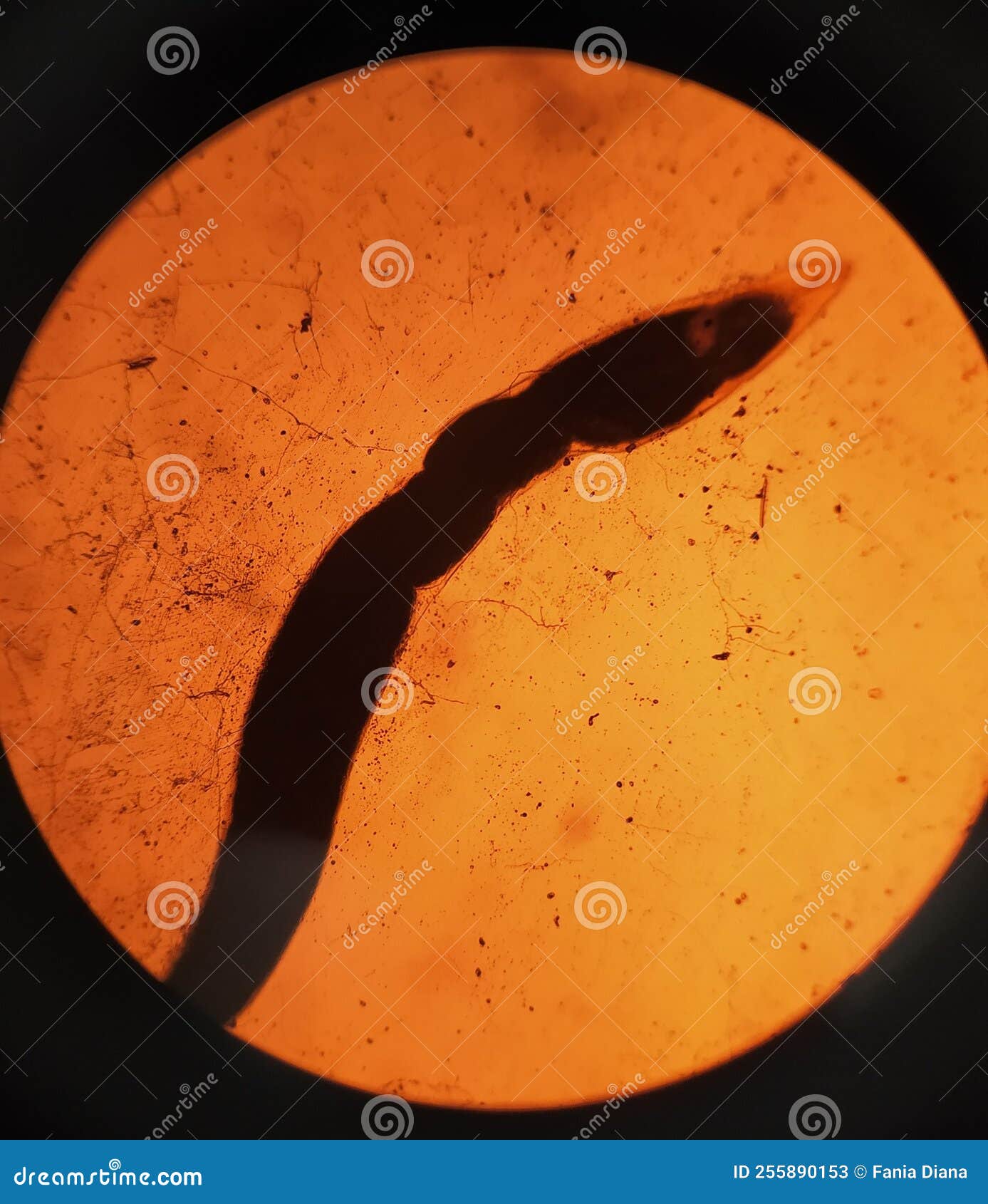 Enterobius Vermicularis Au Microscope Parasite Humain. Image stock ...