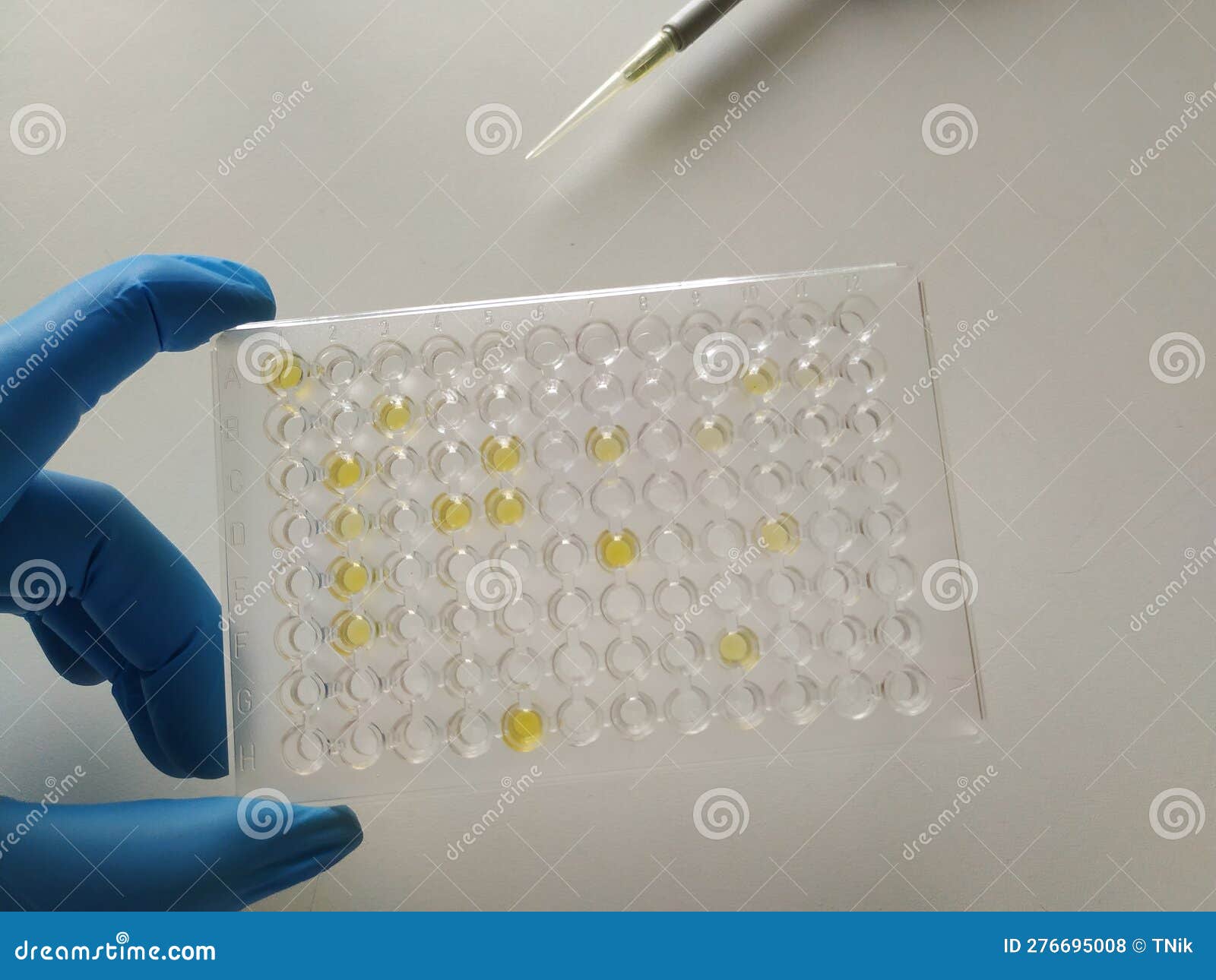 Immunology Testing Method in Laboratory Stock Photo - Image of room ...