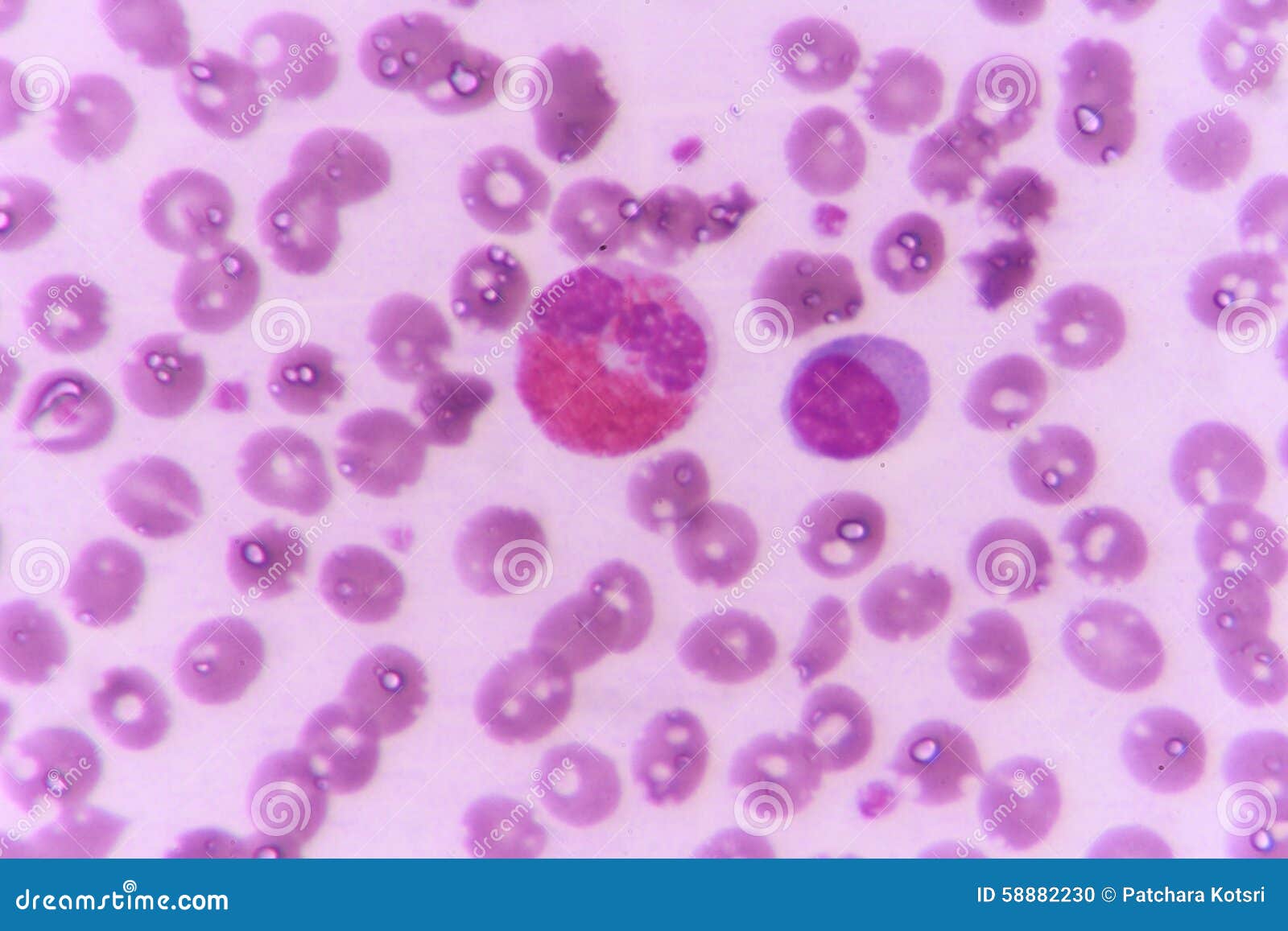 What Are Eosinophils Definition Low High Reference