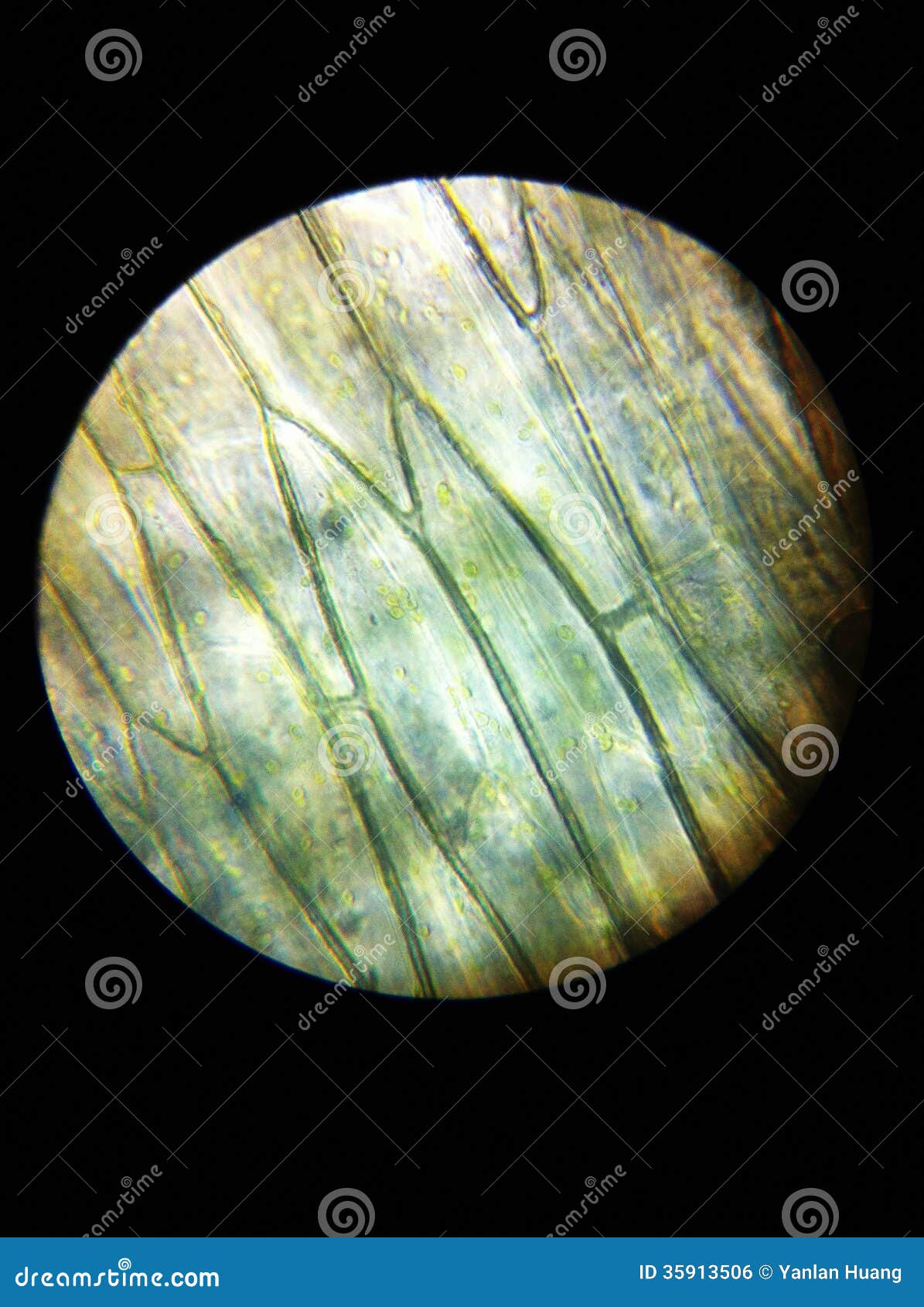 The Epidermal Cells of Cabbage Stock Photo - Image of green, autoplast ...