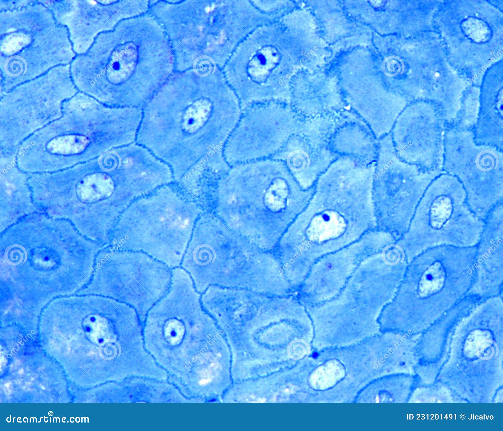 Epidermis. Stratum Spinosum Stock Image - Image of epithelial ...