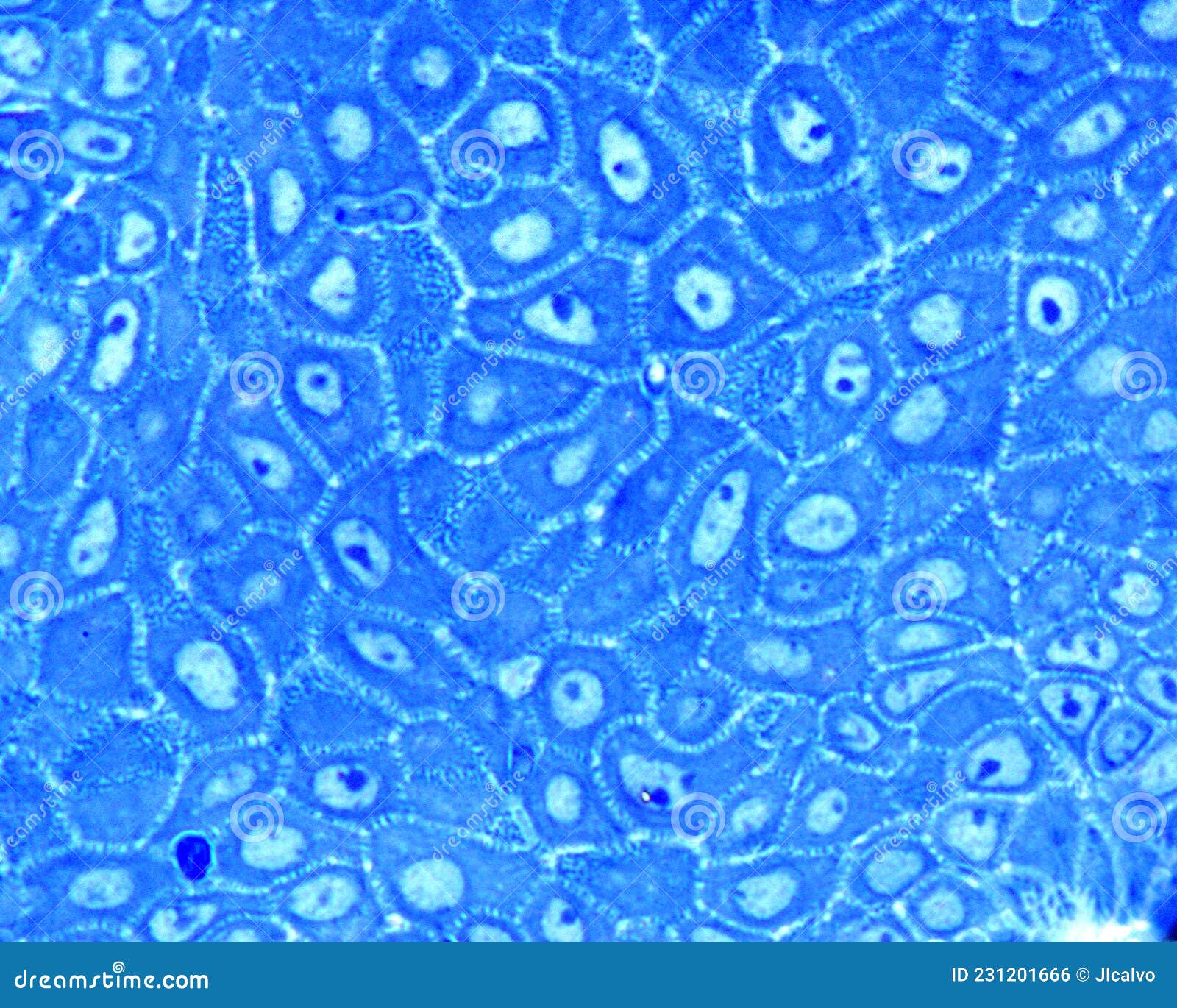 Epidermis. Stratum Spinosum Stock Photo - Image of stratified ...