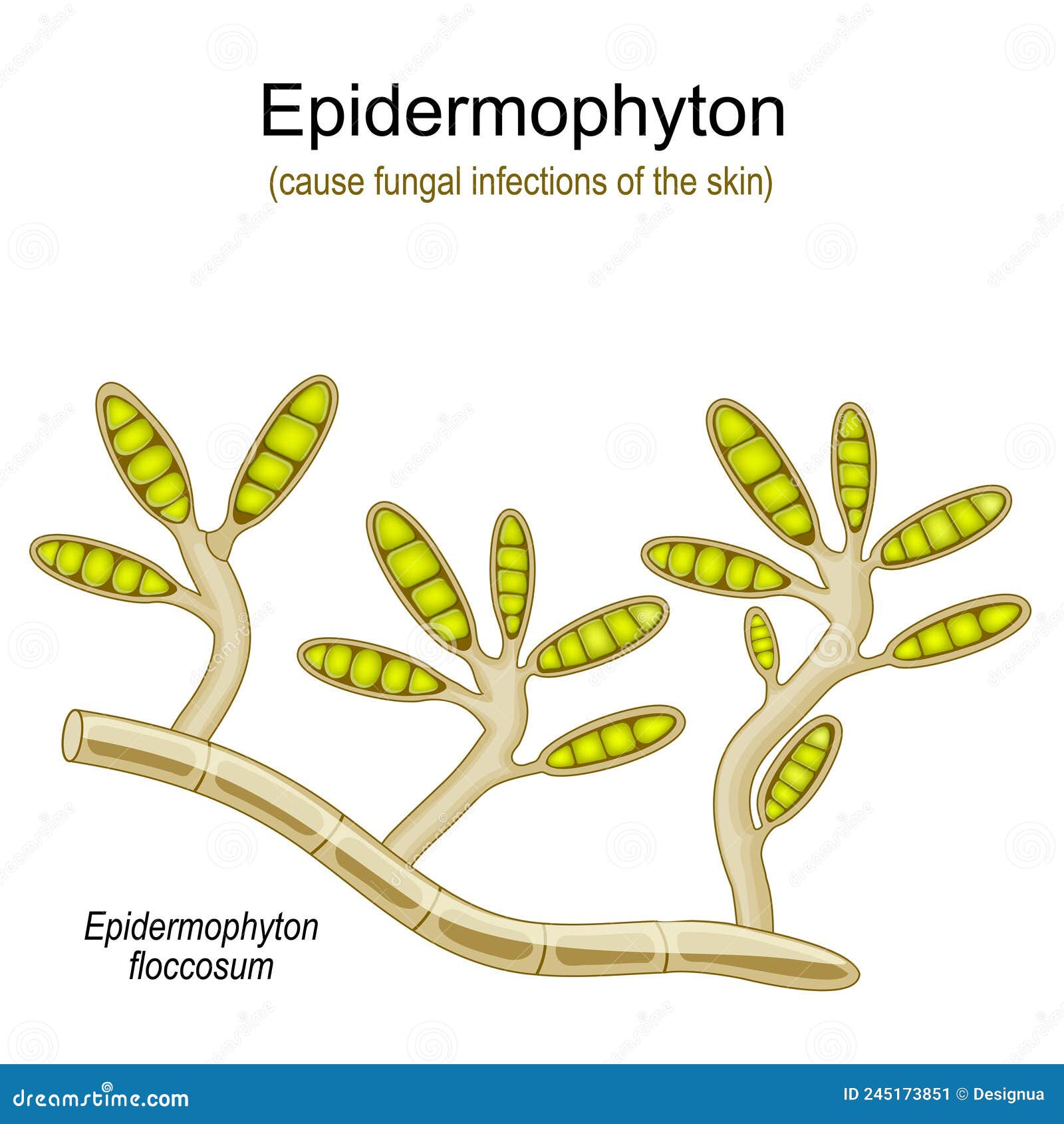 Epidermophyton Floccosum. Fungal Infections Stock Vector - Illustration ...