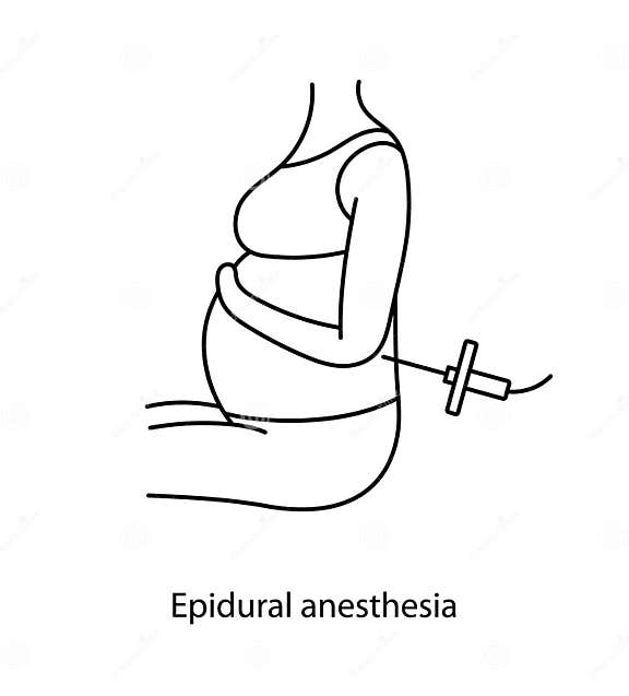 Epidural Anesthesia before Childbirth, Line Icon in Vector. Stock ...