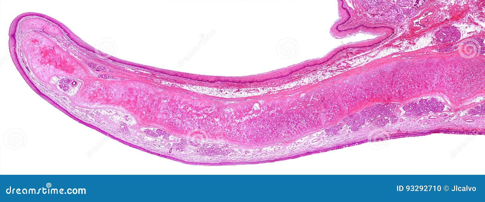 Epiglotis humana foto de archivo. Imagen de laringe, célula - 93292710