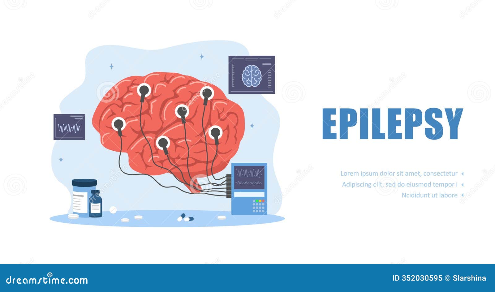 Epilepsy Concept. Electroencephalography. Brain Connected To Display ...