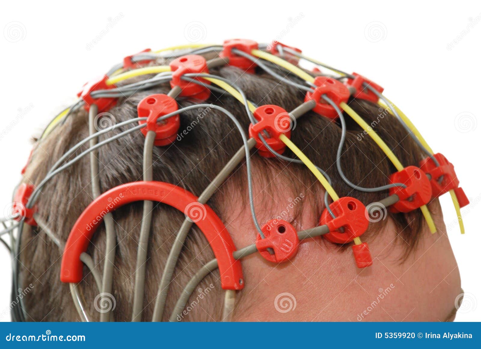 Epilepsy examination stock photo. Image of sensor, medicine - 5359920