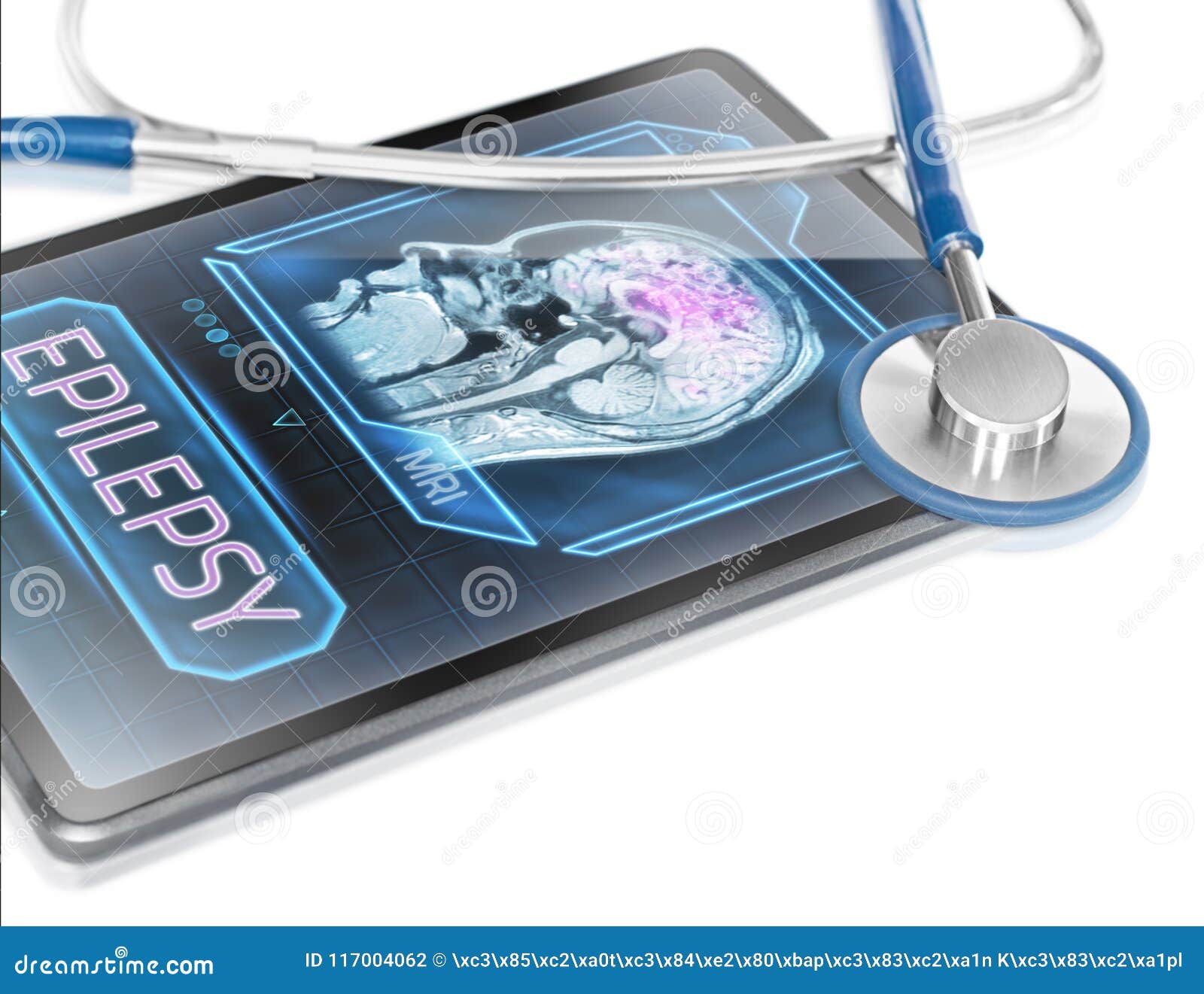 Epilepsy stock photo. Image of epileptic, brain, high - 117004062