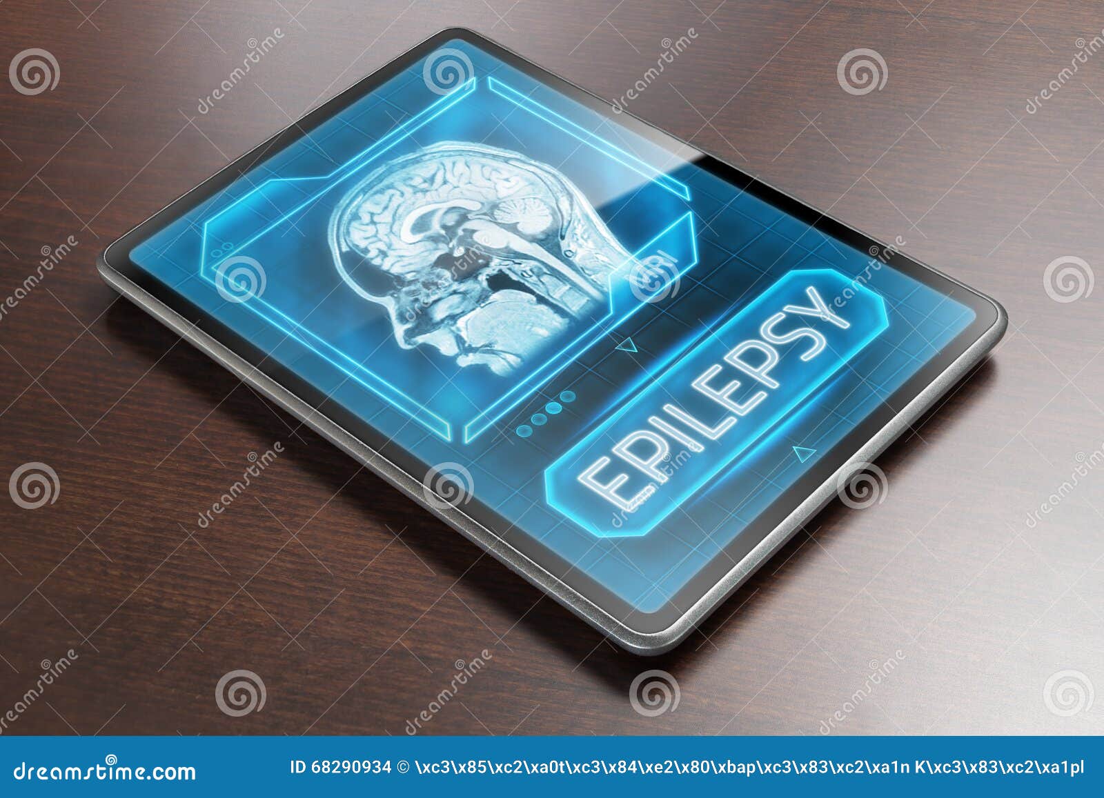 Epilepsy stock photo. Image of head, display, exam, magnetic - 68290934