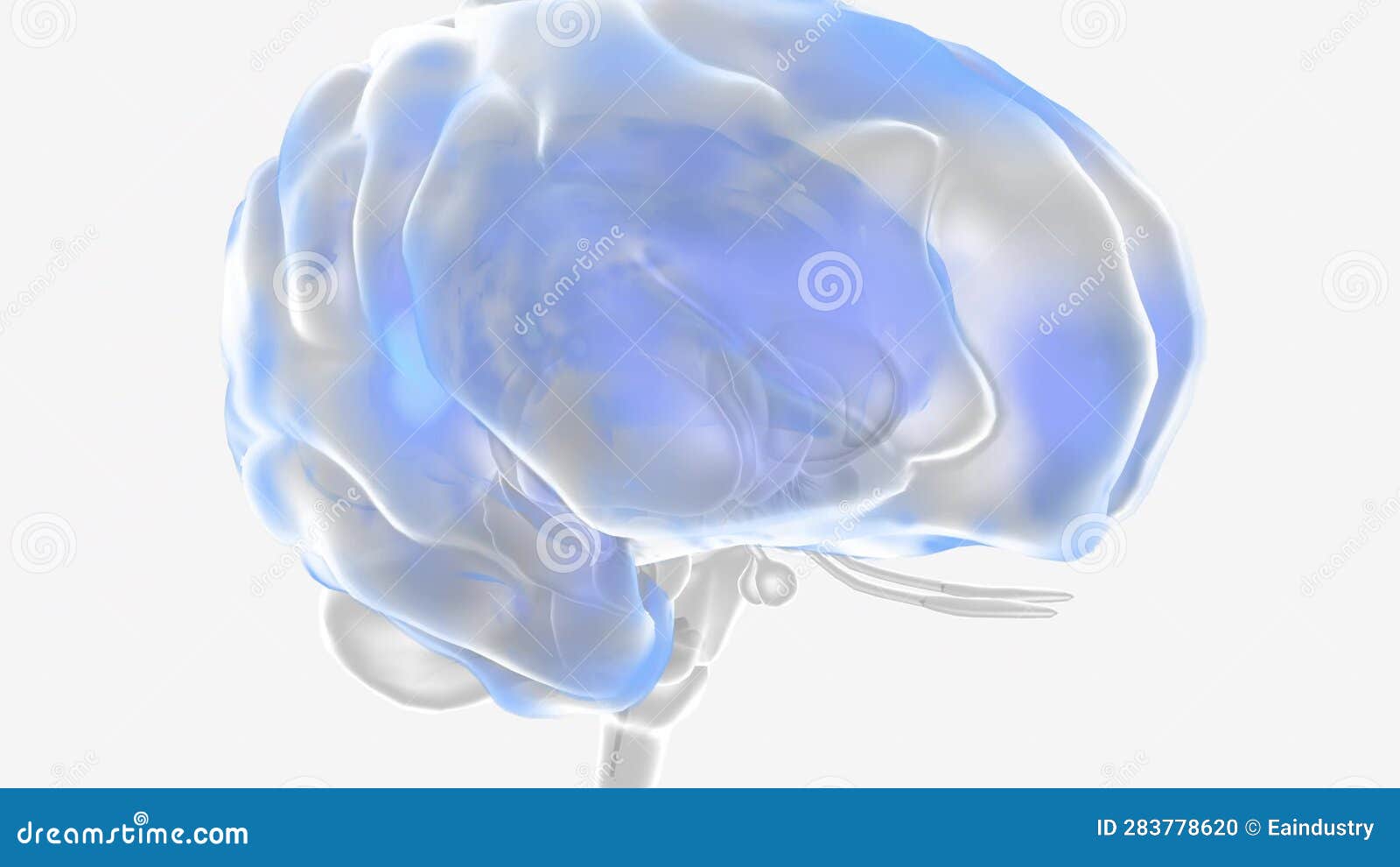 Epileptic Seizure Caused by Abnormal Electrical Activity in Brain Stock ...