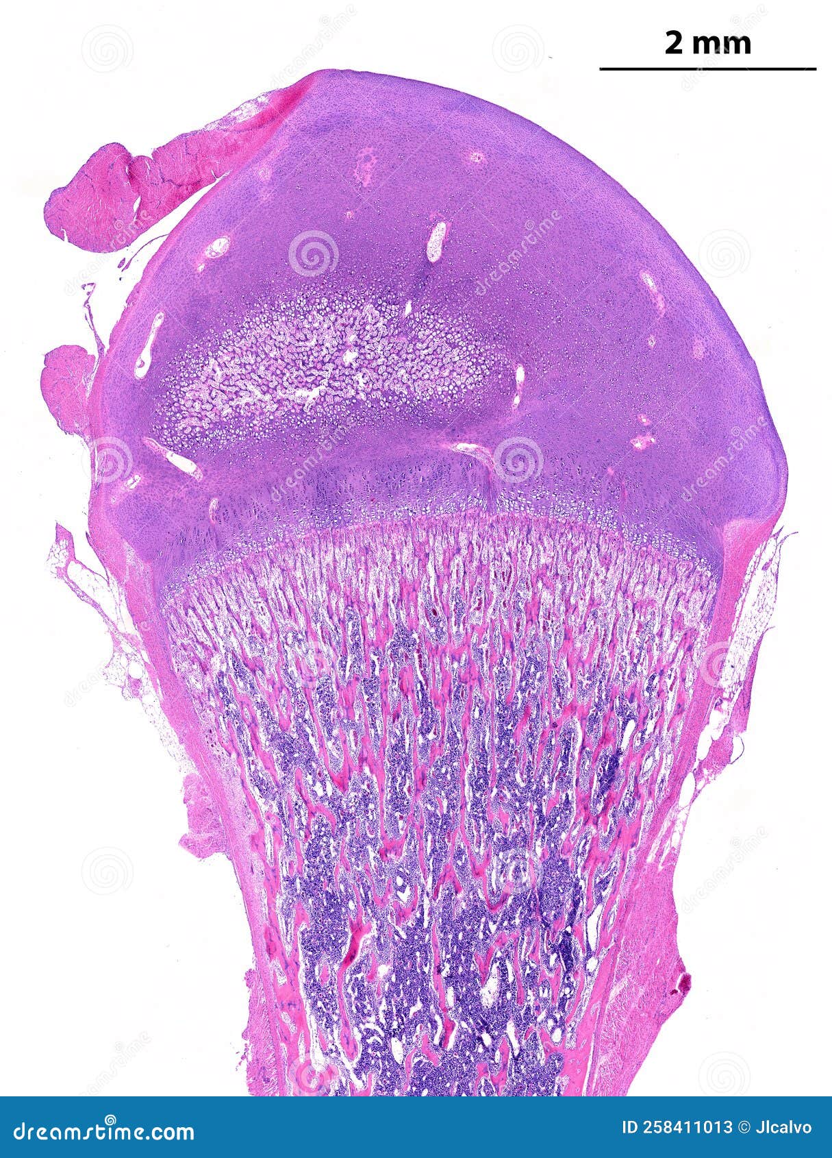 Epiphysis. Secondary Ossification Centre Stock Image - Image of hyaline ...