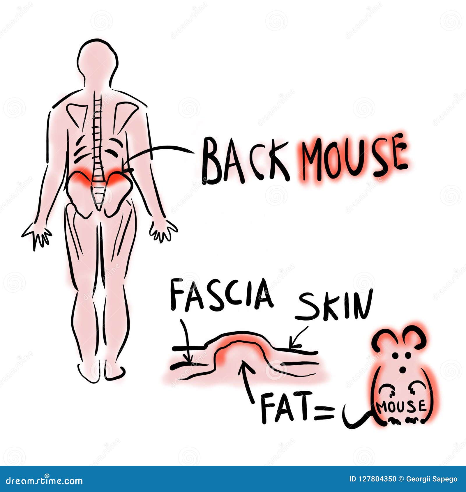 Episacral Lipoma or Back Mouse Stock Illustration - Illustration of ...