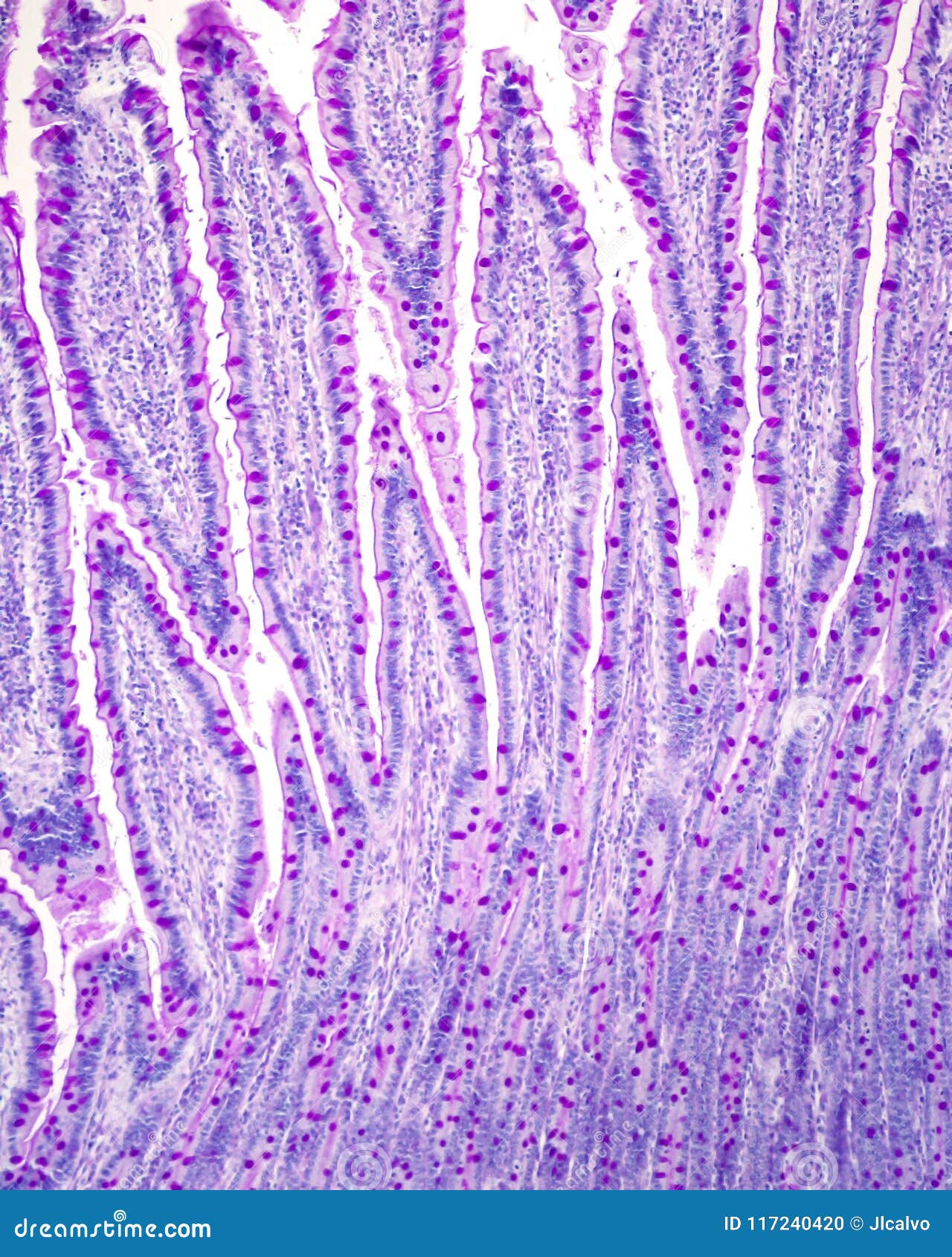 Epitelio Intestinal Células De Cubilete Foto de archivo - Imagen de ...