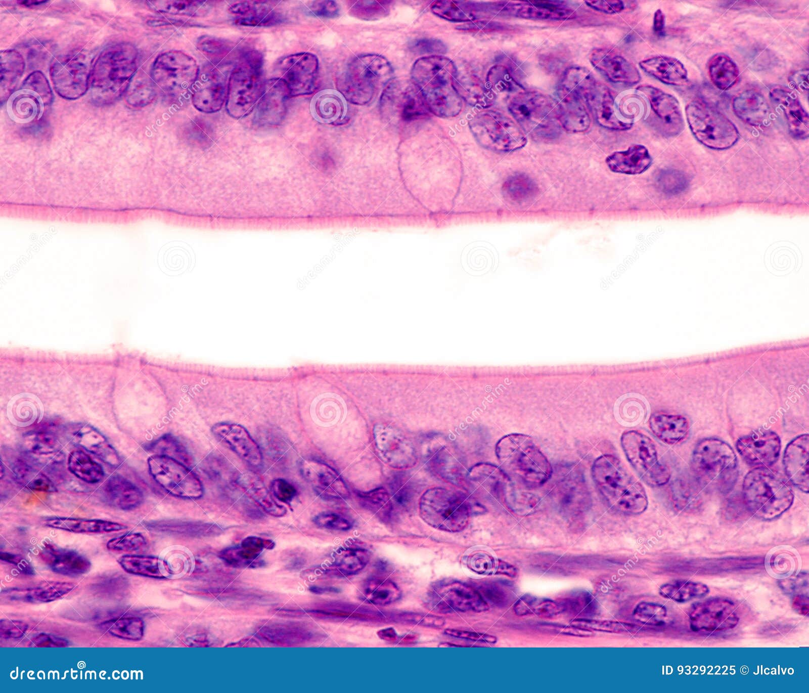 Epitelio Intestinal Frontera De Cepillo Imagen de archivo - Imagen de ...