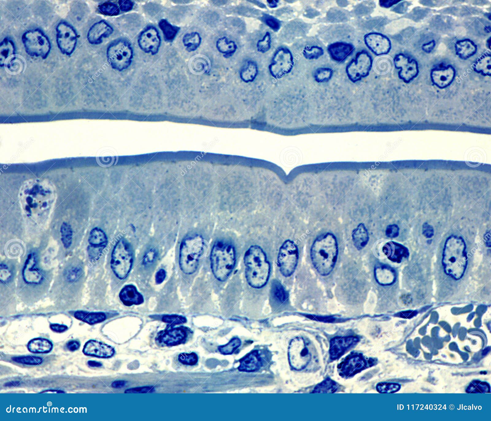 Epitelio Intestinal Sección De Semithin Foto de archivo - Imagen de ...