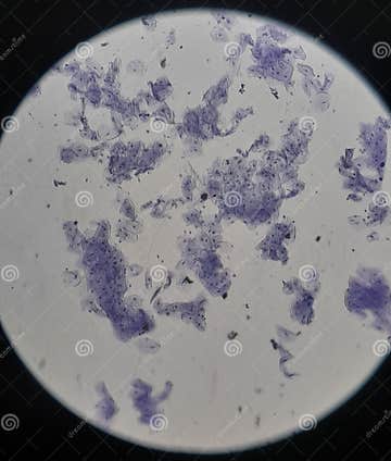 Epithelial Cells of Human Oral Cavity Under the Microscope Stock Photo ...